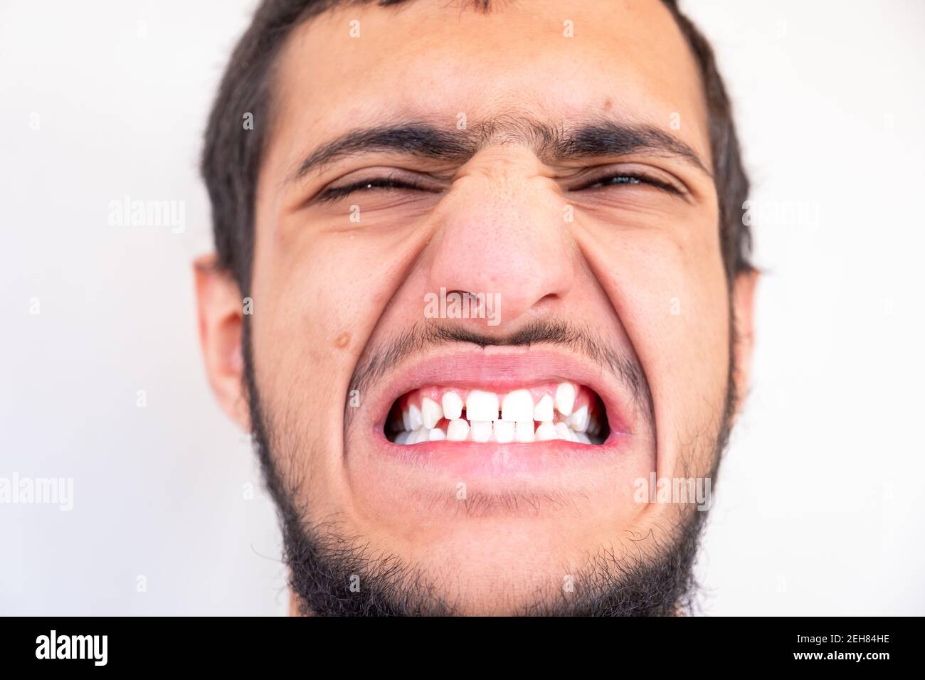 Arabic boy closeup to his teeth while he tightens them Stock Photo - Alamy