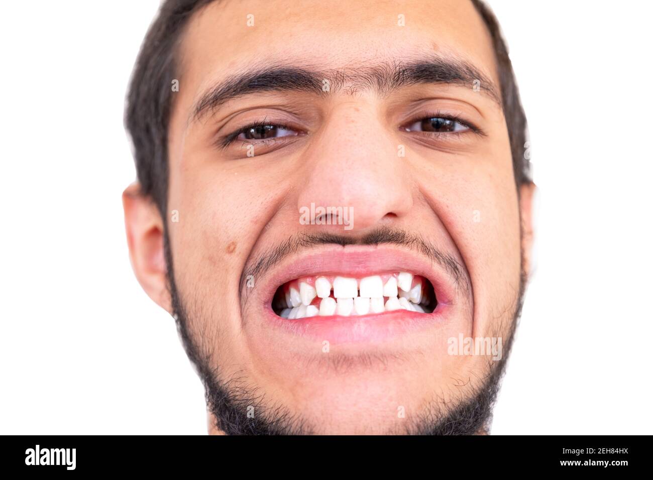 Arabic boy closeup to his teeth while he tightens them Stock Photo - Alamy