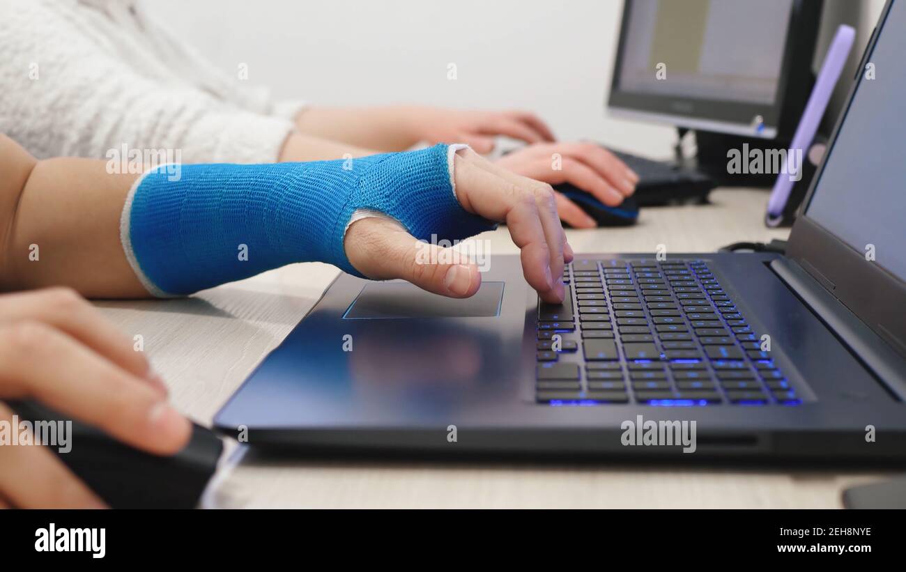 Fiberglass cast hi-res stock photography and images - Alamy