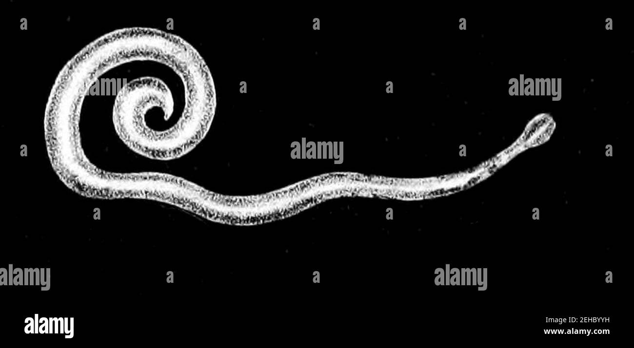 Oxyuris vermicularis Black and White Stock Photos & Images - Alamy