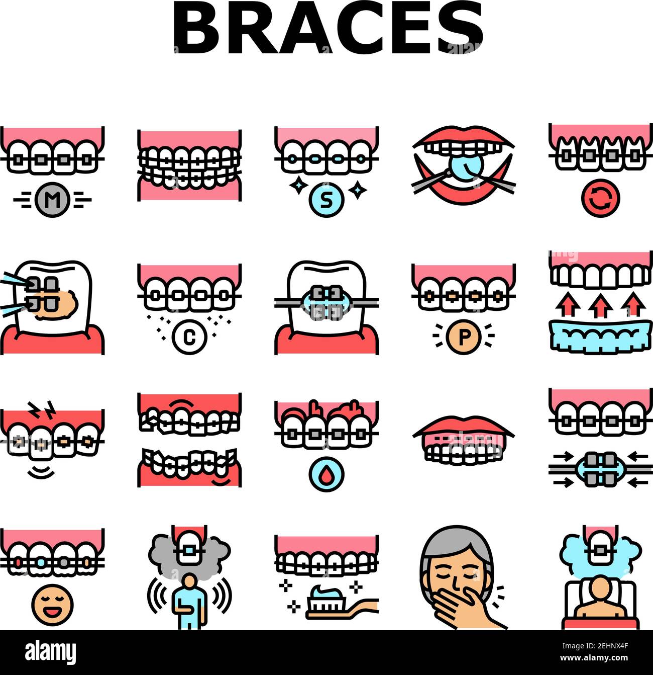 Tooth Braces Accessory Collection Icons Set Vector Stock Vector Image ...