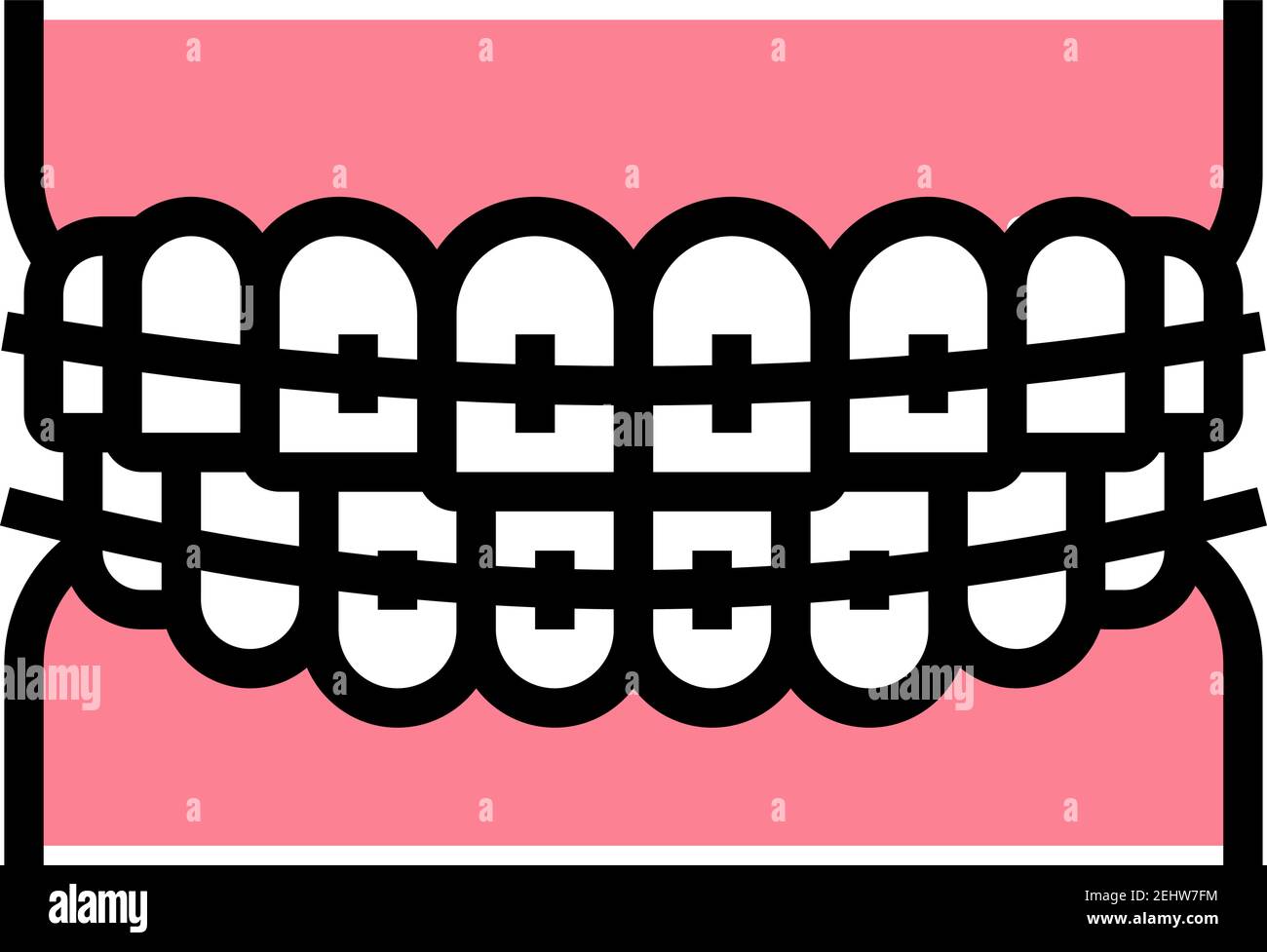 tooth braces color icon vector illustration Stock Vector Image & Art ...