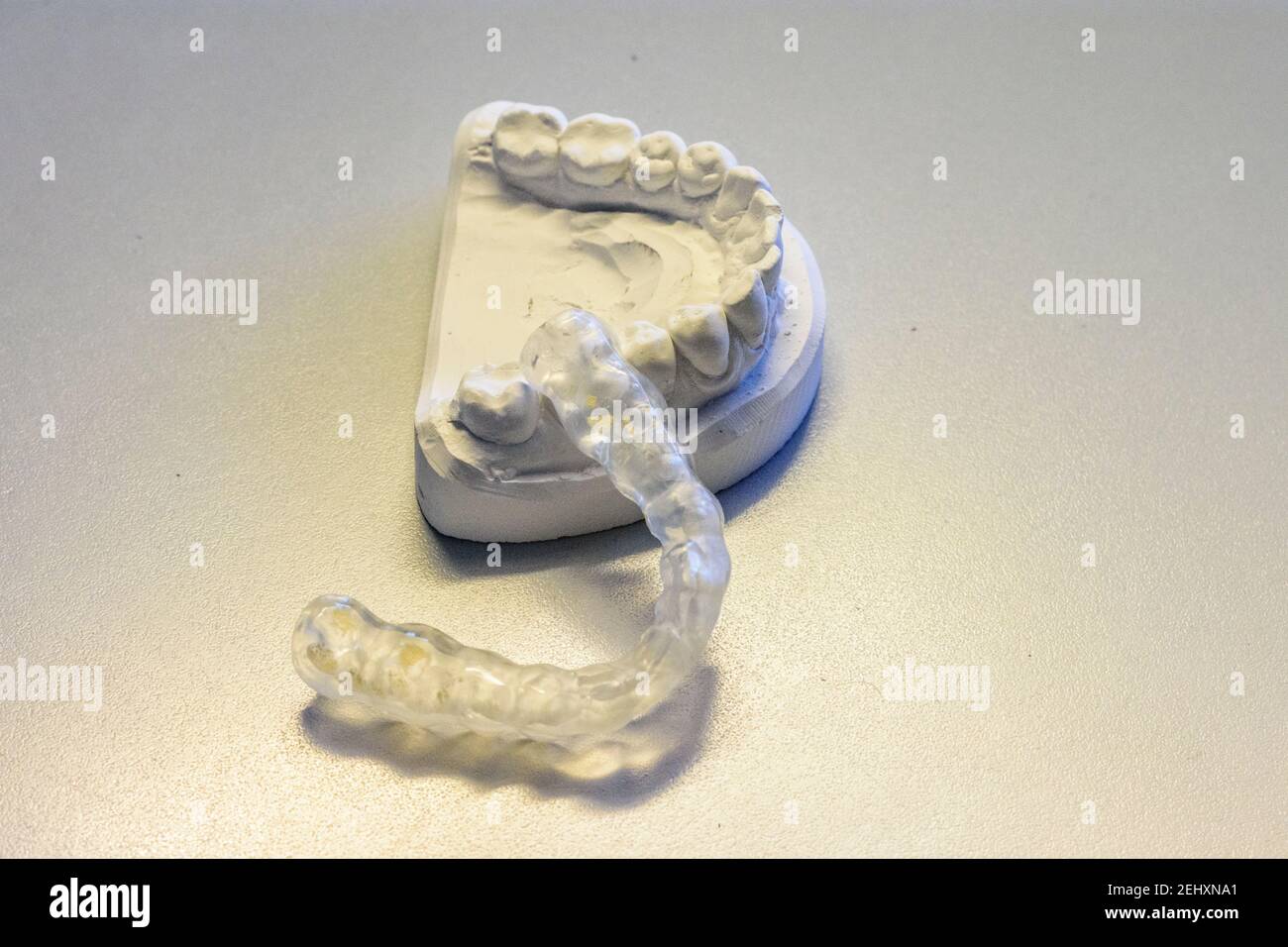 Occlusal splint hi-res stock photography and images - Alamy