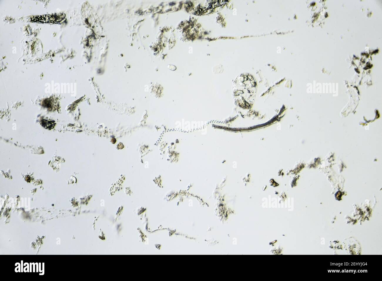 Spirochete hi-res stock photography and images - Alamy