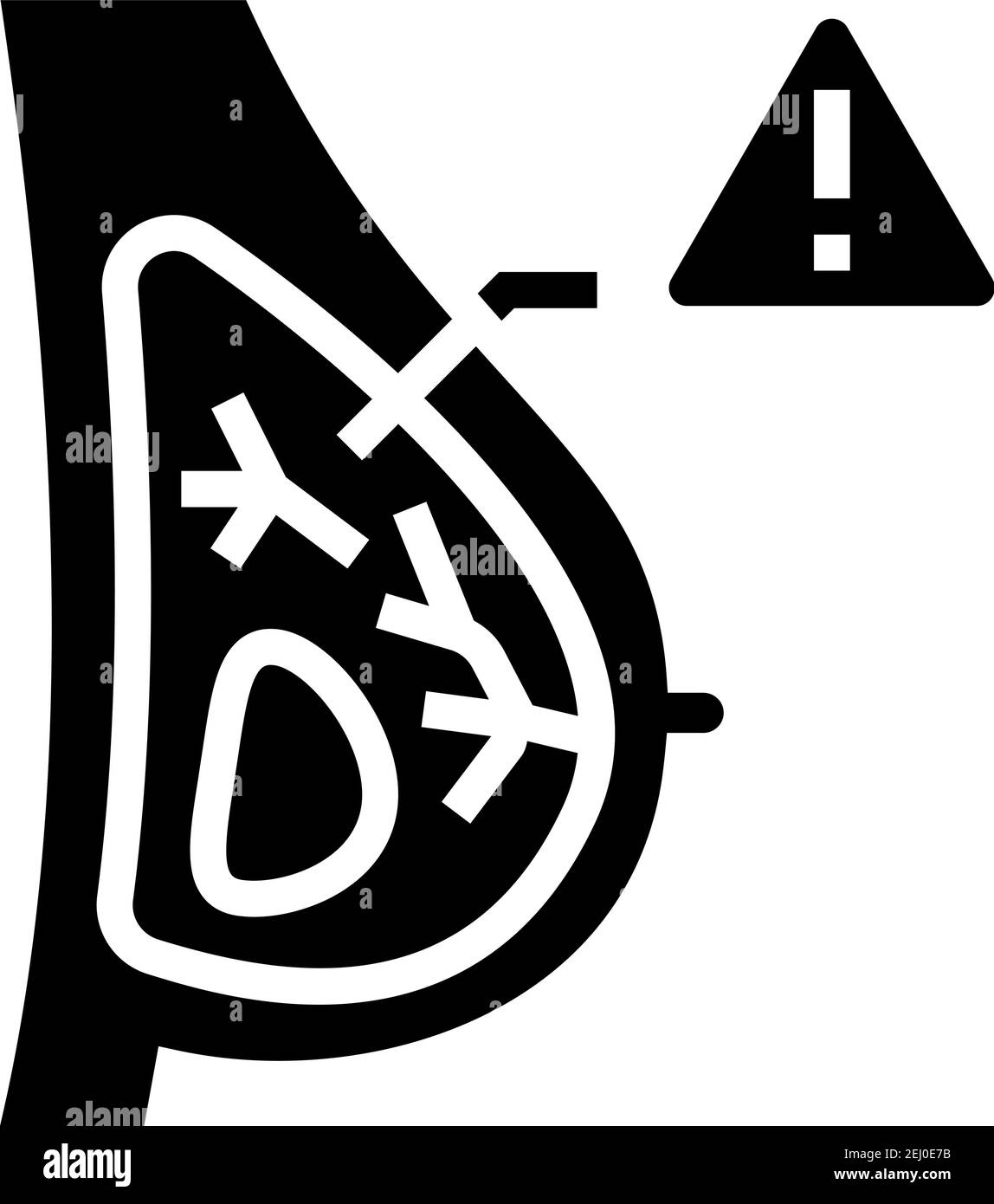 lump in chest glyph icon vector illustration Stock Vector Image & Art ...