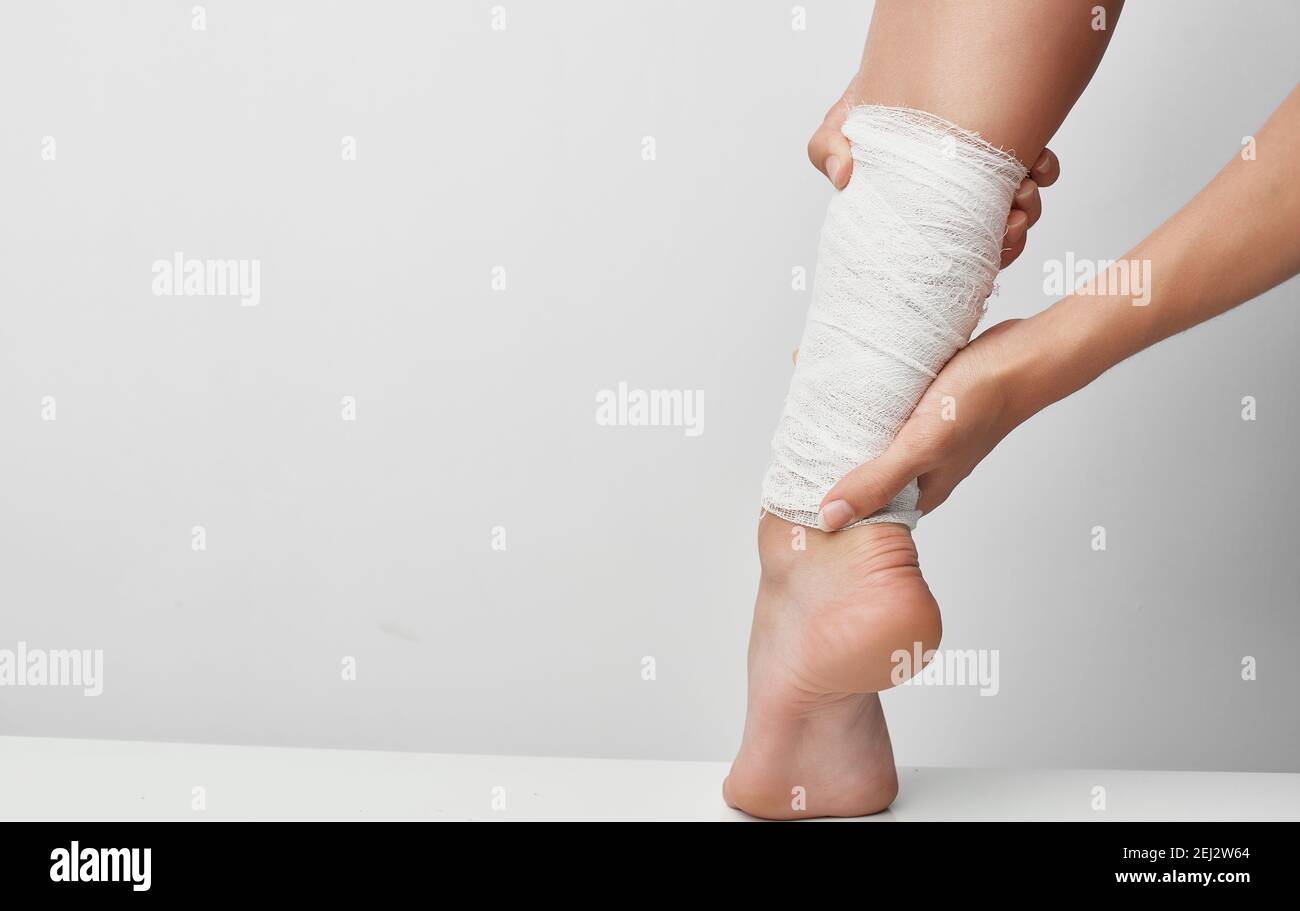 summer injury female leg bandage health problems pain Stock Photo - Alamy