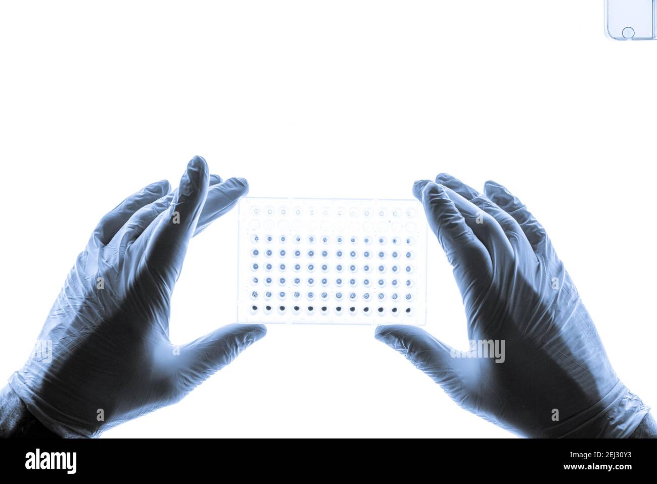 Dna Samples Are Loaded To 96-Well Plate For Pcr Analysis Stock Photo ...