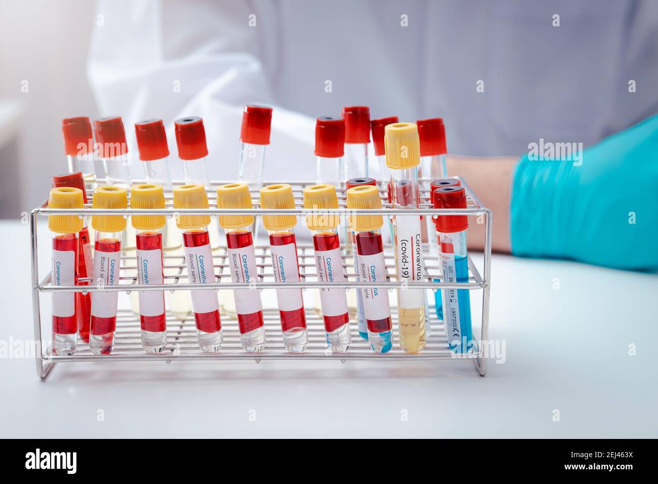 Blood samples and plasma in tubes on work table in a medical ...