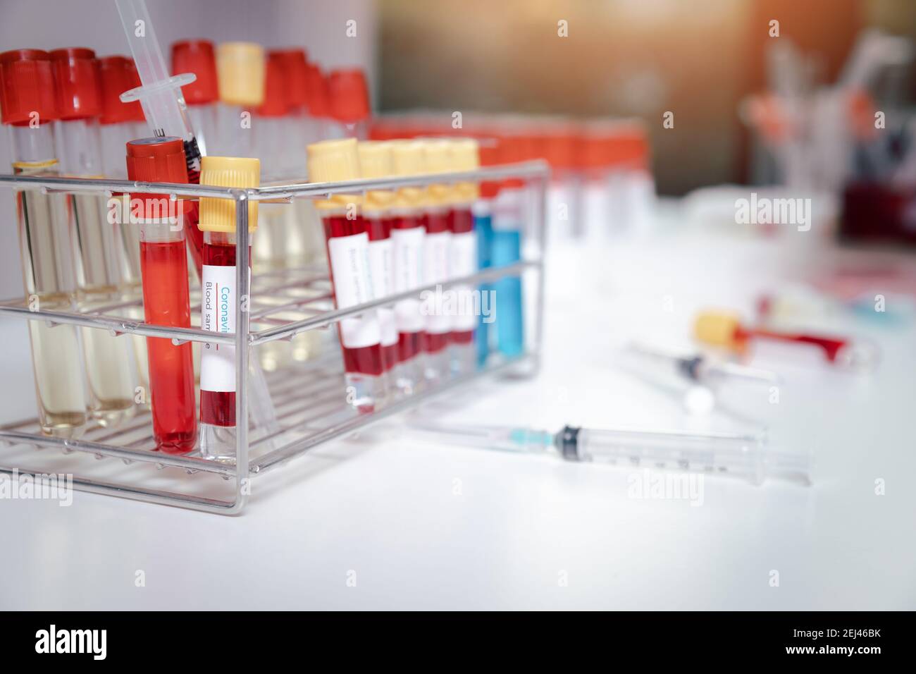 Blood samples in tubes and syringes on work table in a medical ...