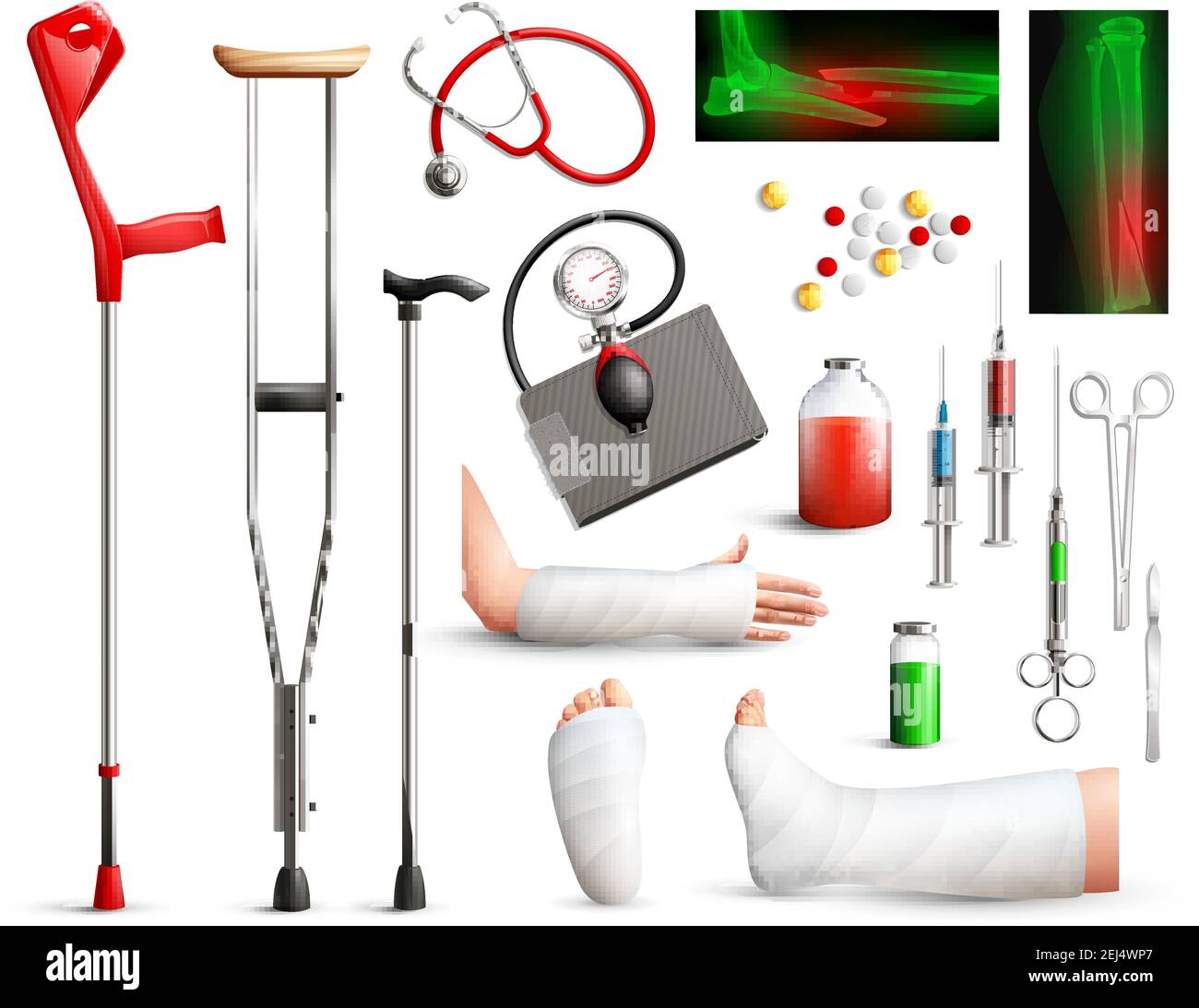 Trauma surgery realistic set with radiograph plastered limbs stick ...