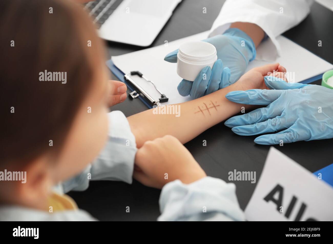 Little girl undergoing allergen skin test in clinic Stock Photo - Alamy