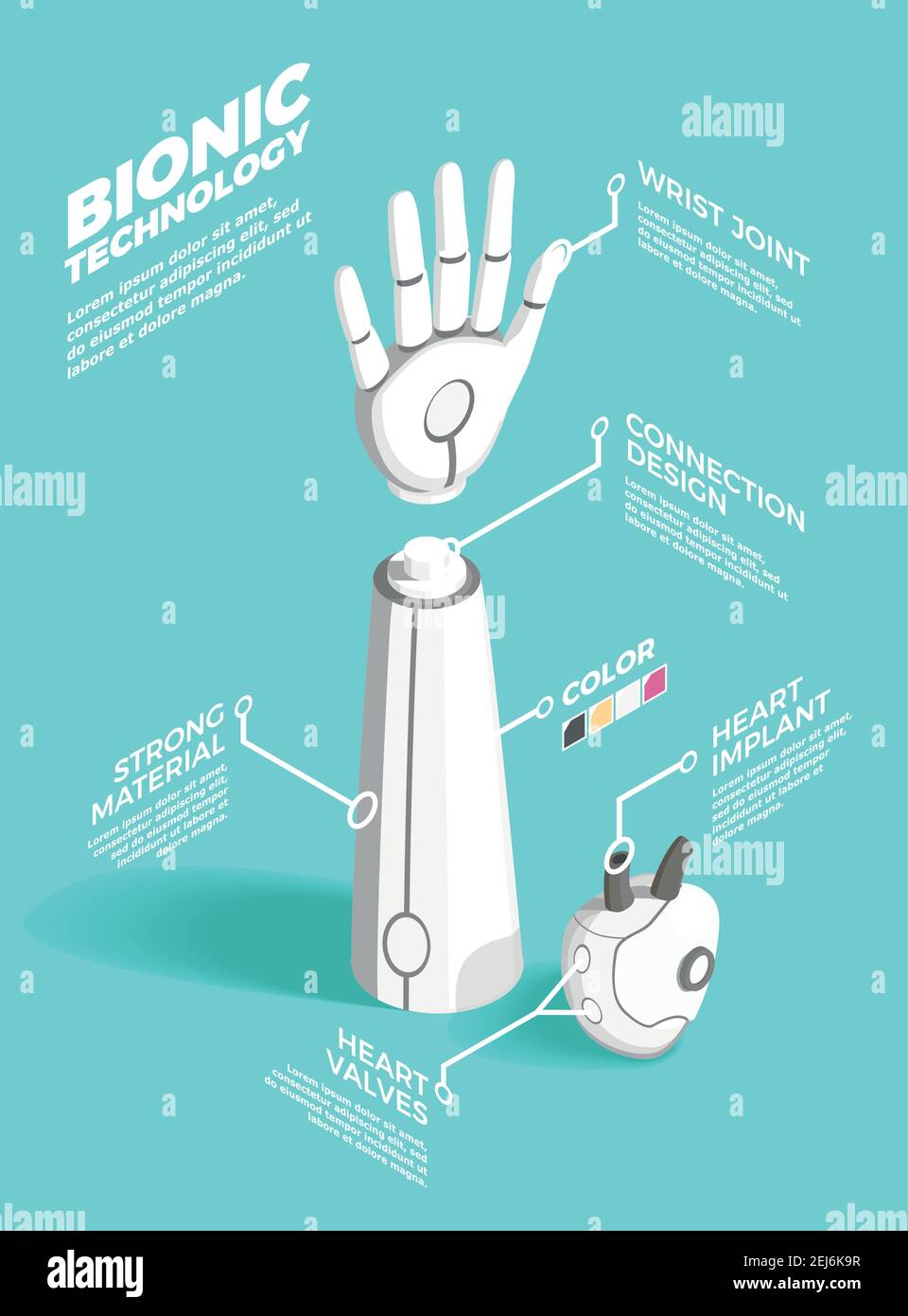 Bionics technology isometric composition illustrating implants ...
