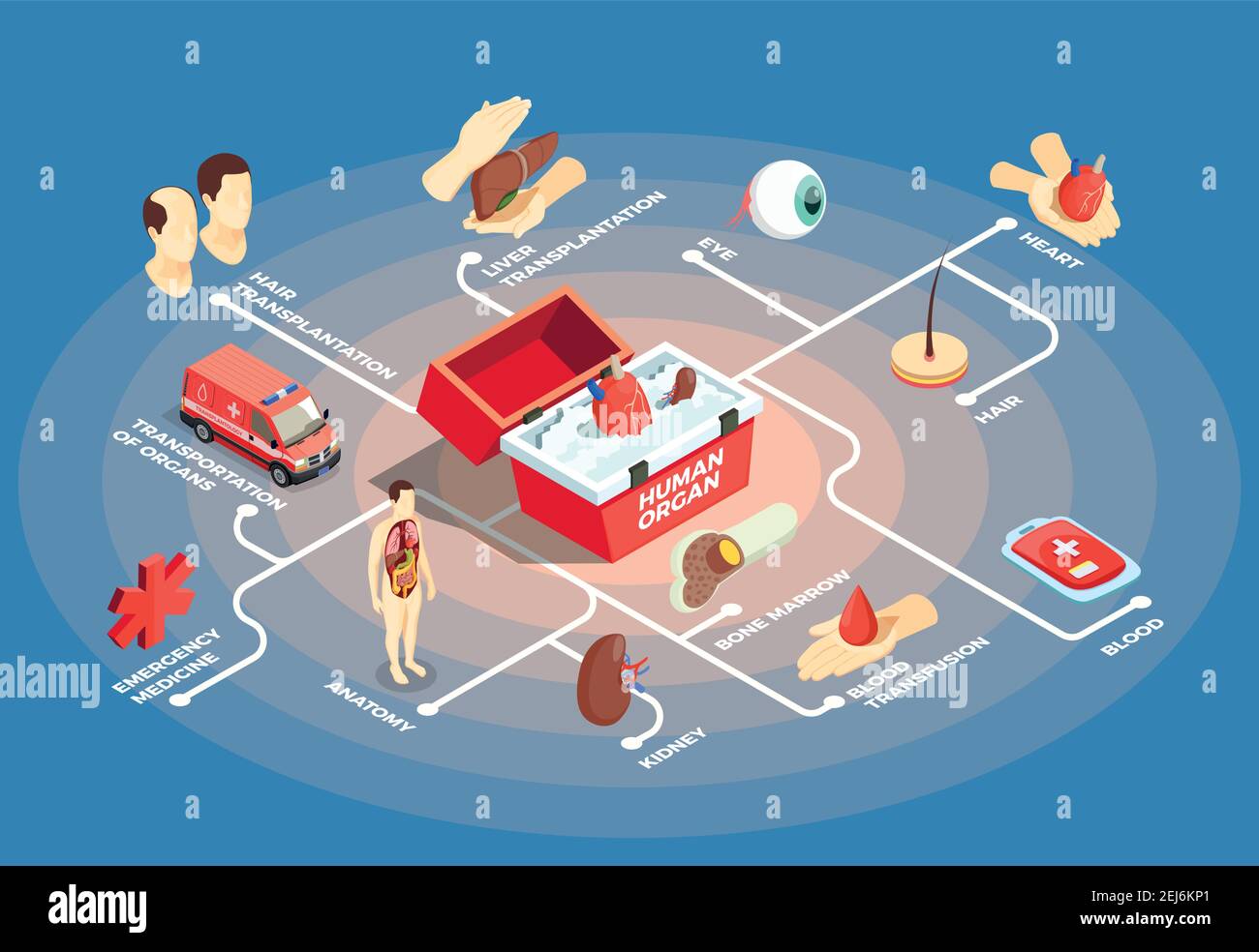 Transplantation isometric flowchart with donor heart in medical case ...