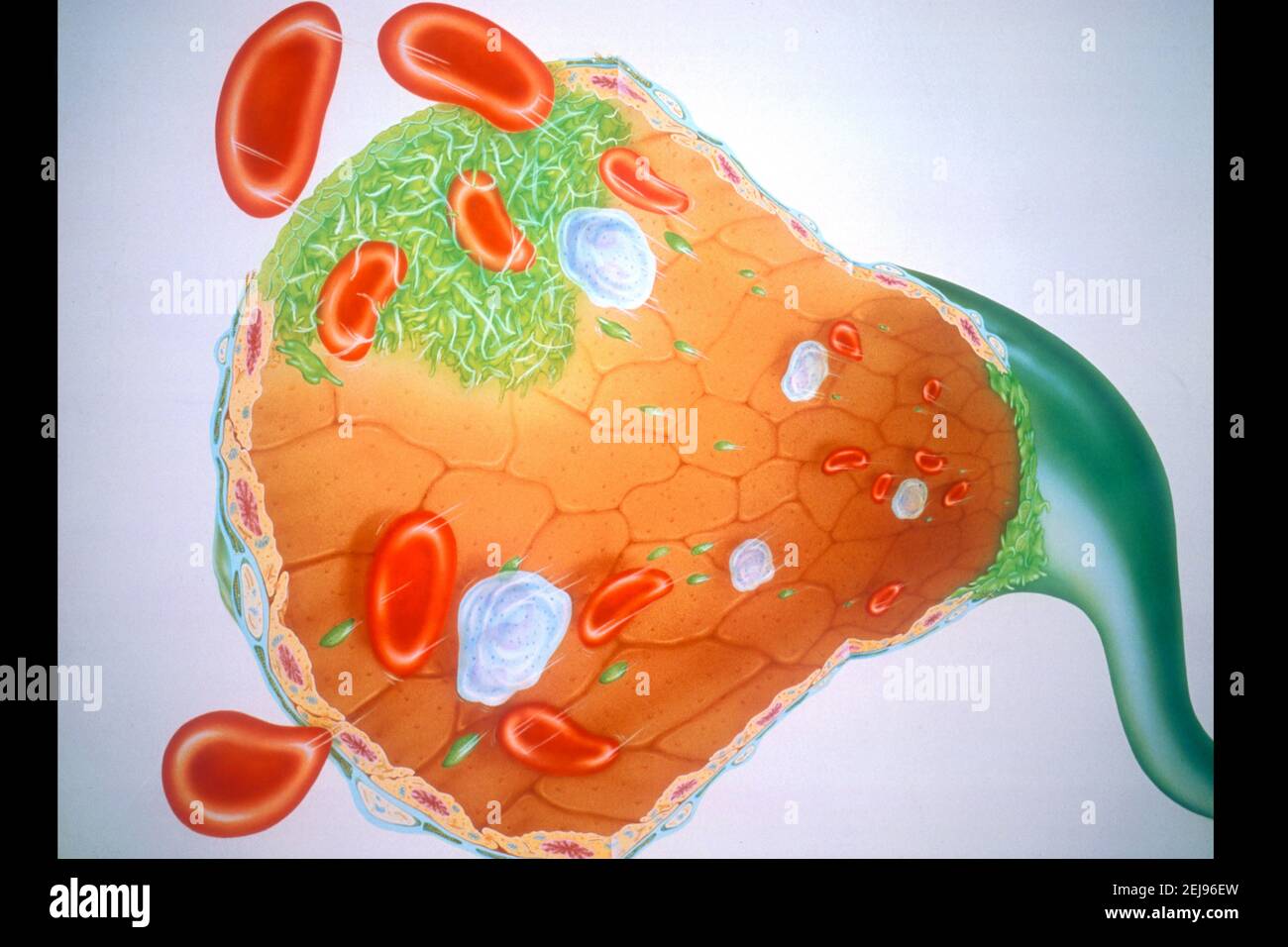 Haematology artwork hi-res stock photography and images - Alamy