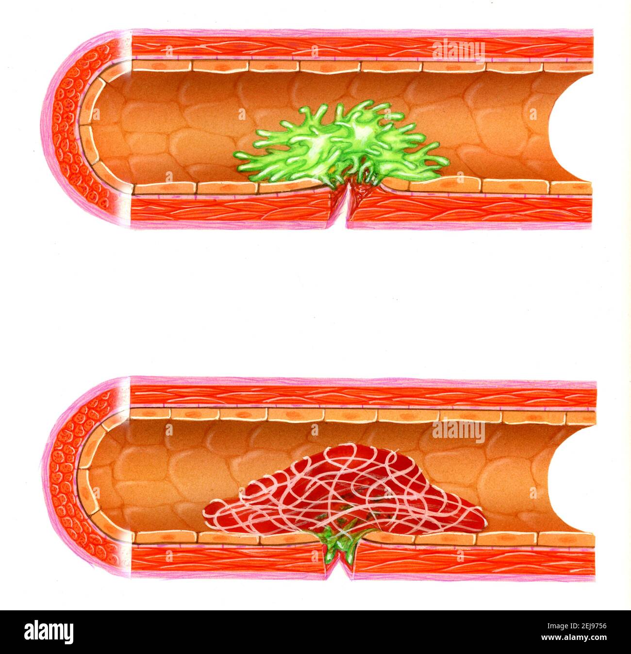 Coagulum High Resolution Stock Photography and Images - Alamy