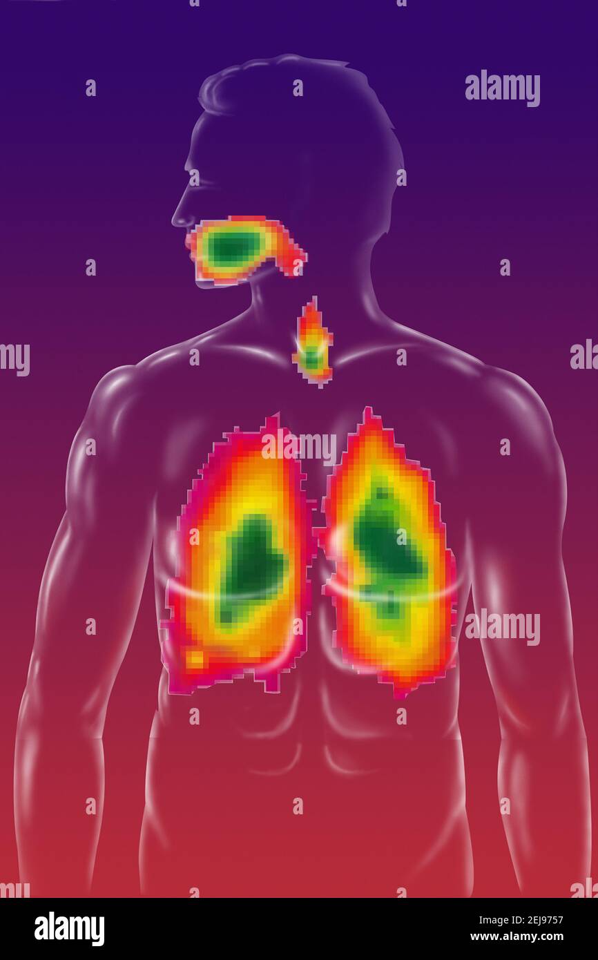 Radioactive tracer hi-res stock photography and images - Alamy