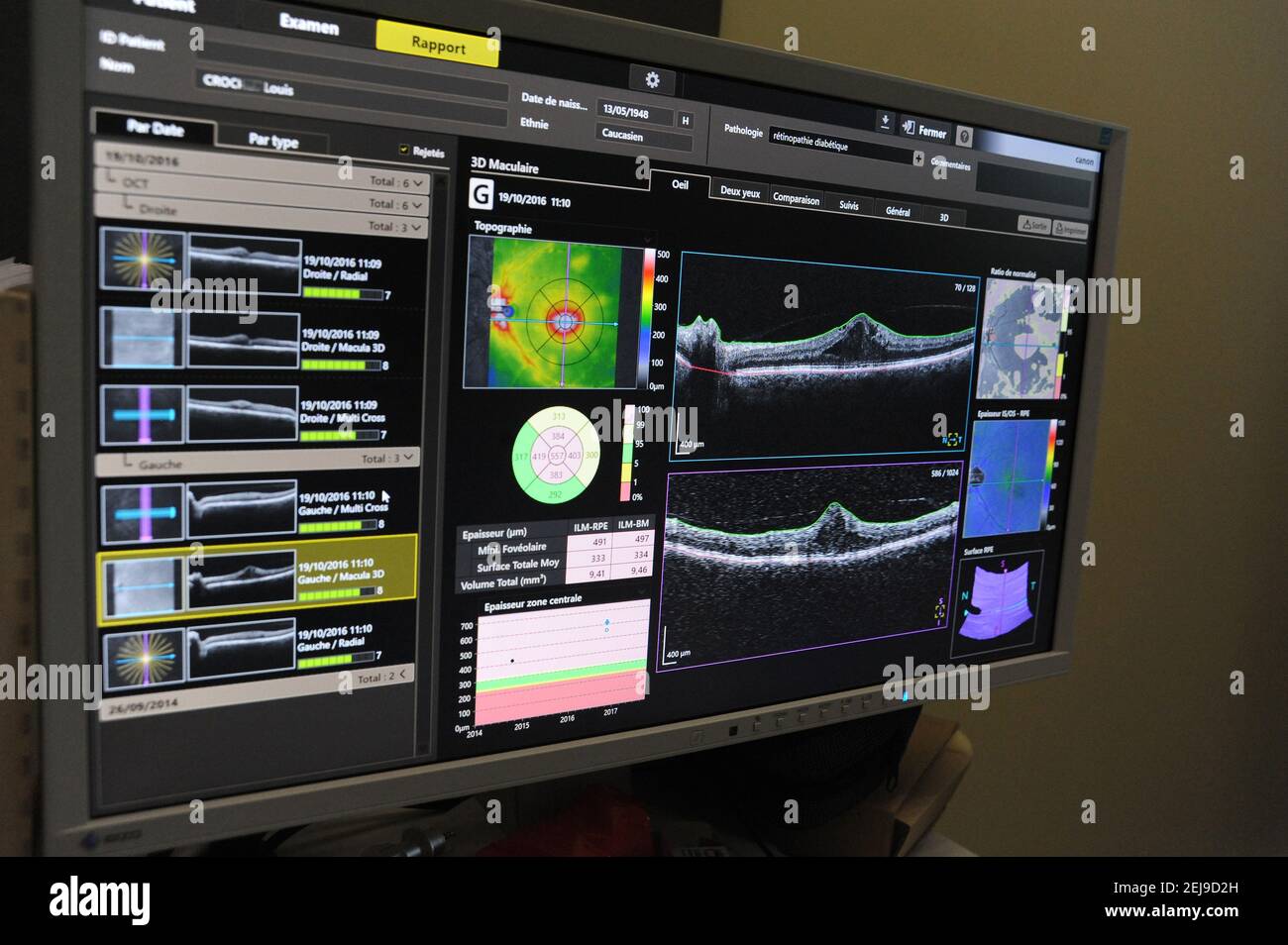 Retinal scanner hi-res stock photography and images - Alamy