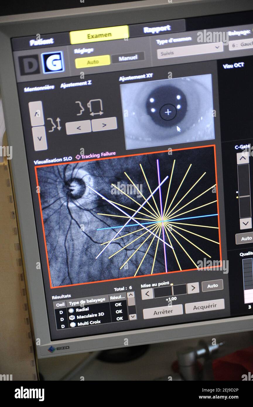 Retinal scanner hi-res stock photography and images - Alamy