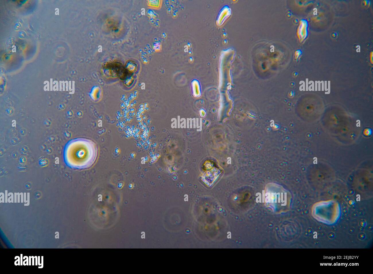 Pathogens magnified by a microscope Stock Photo - Alamy