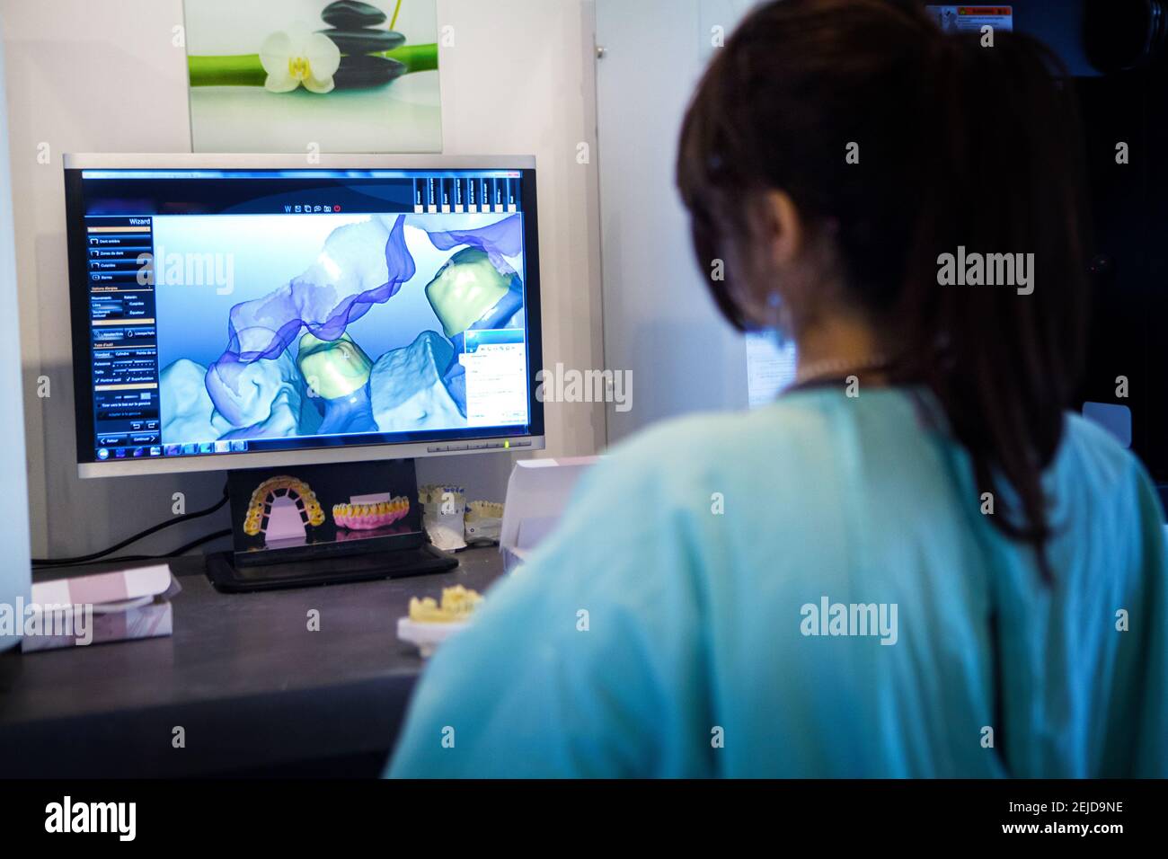 Computer-aided manufacturing of dental prostheses Stock Photo - Alamy