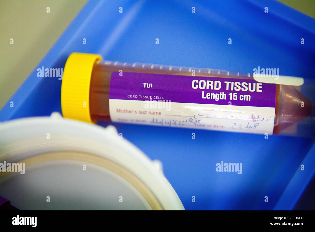 Mesenchymal stem cells hi-res stock photography and images - Alamy