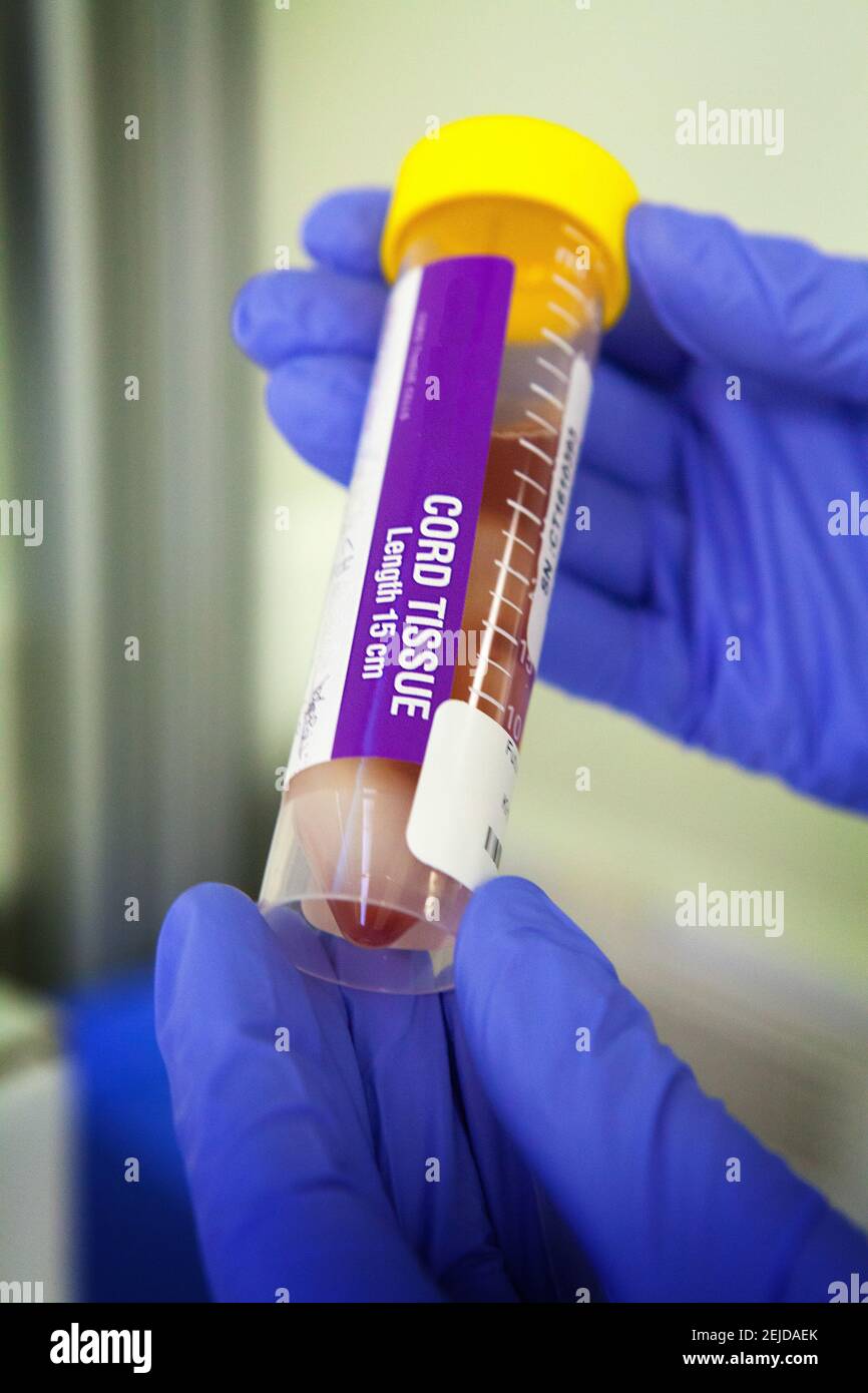 Mesenchymal stem cells hi-res stock photography and images - Alamy