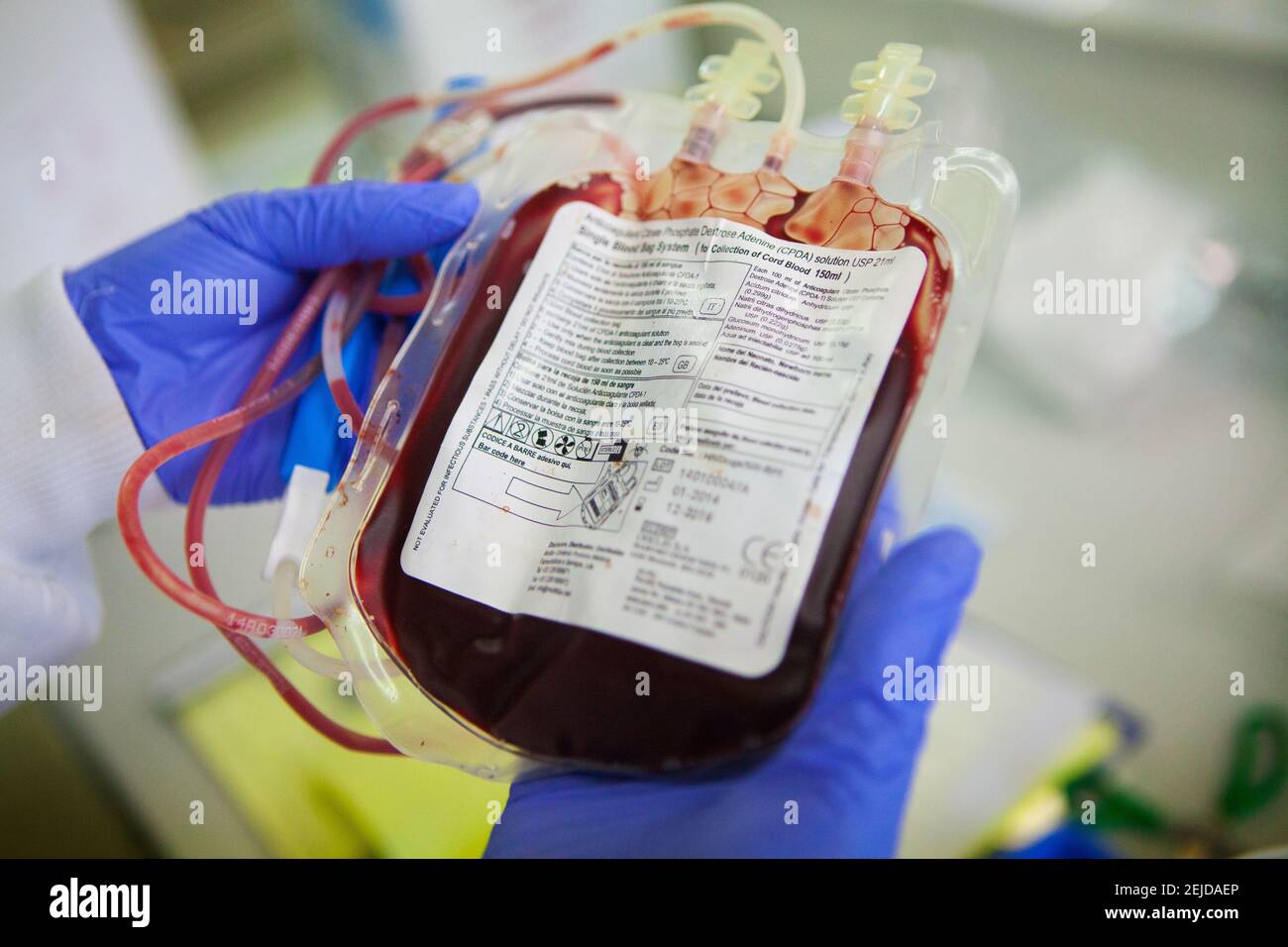 Biobank, bag containing cord blood stem cells (hematopoietic stem cells ...