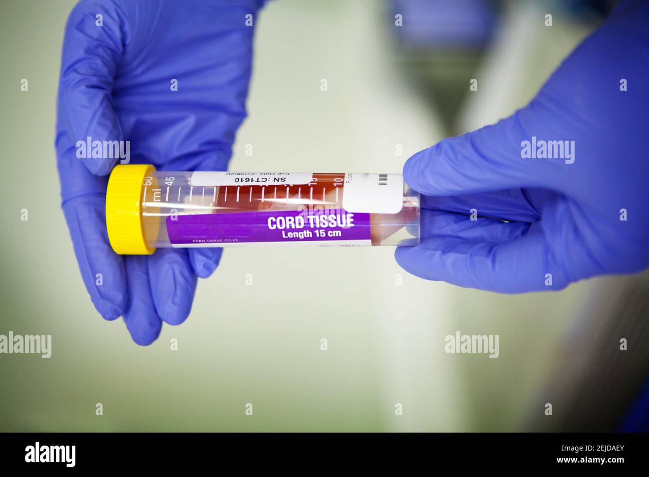 Biobank, tube containing umbilical cord stem cells (mesenchymal stem ...