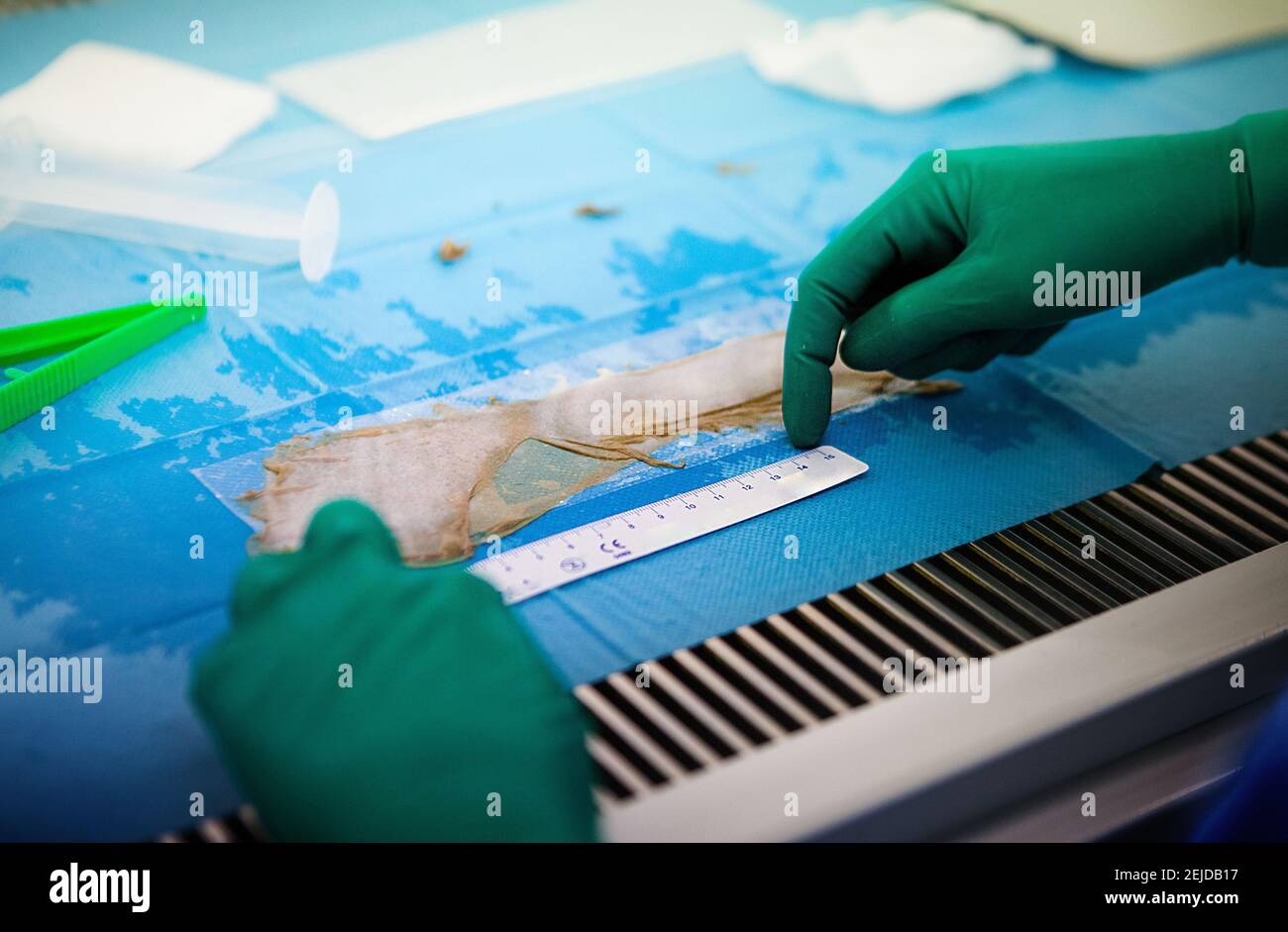 Preparation of skin samples for skin grafting Stock Photo - Alamy
