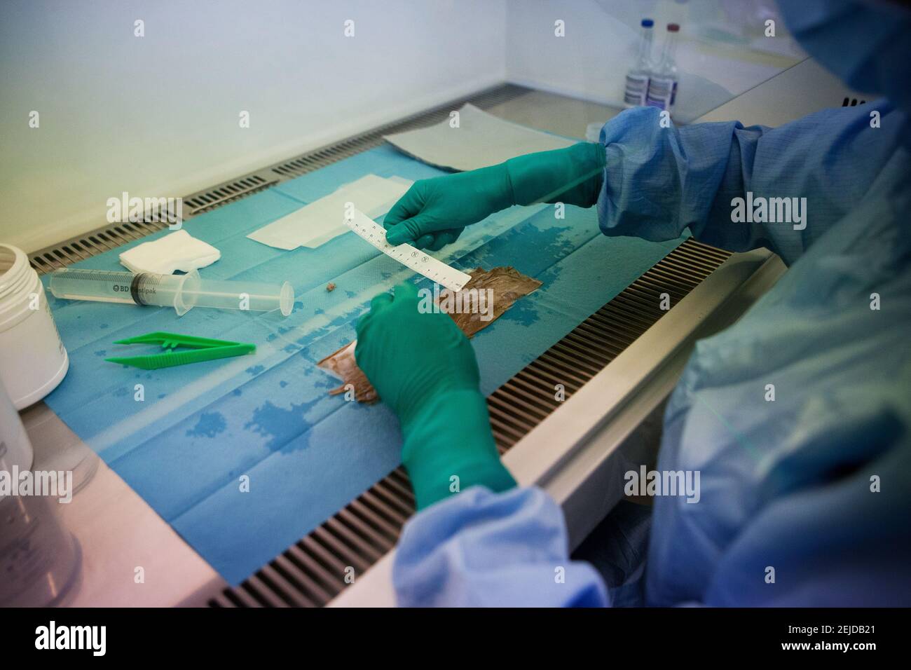 Preparation of skin samples for skin grafting Stock Photo - Alamy
