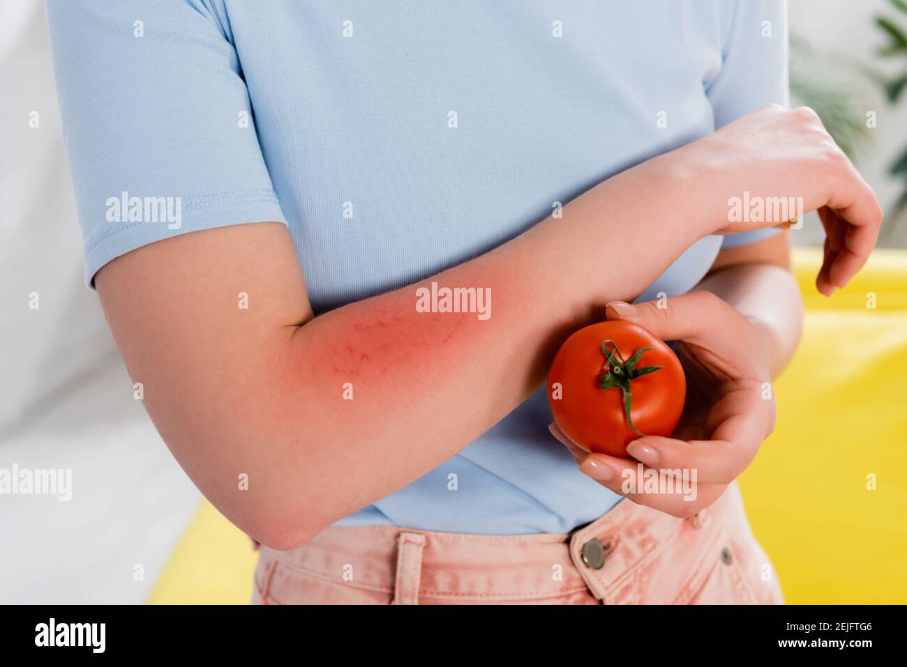 Tomato Allergy High Resolution Stock Photography and Images - Alamy
