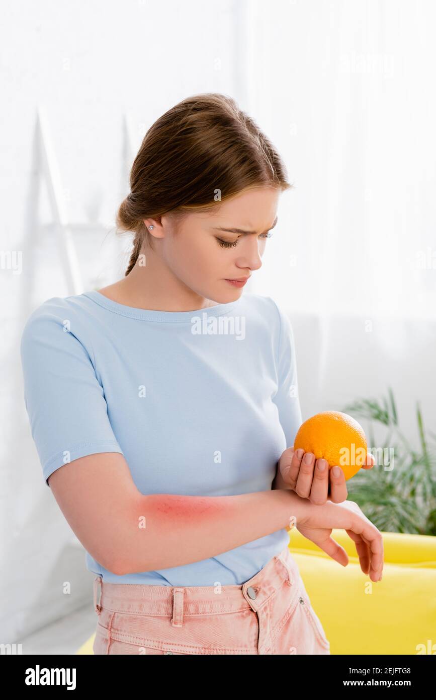 Allergy reaction hi-res stock photography and images - Alamy