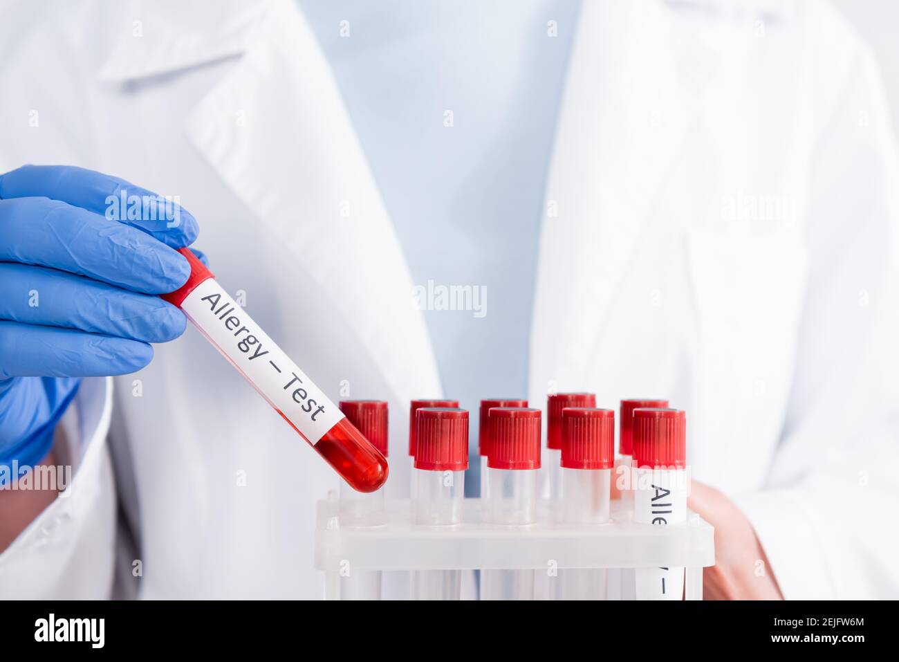 Cropped view of doctor holding test tubes with allergy test lettering ...