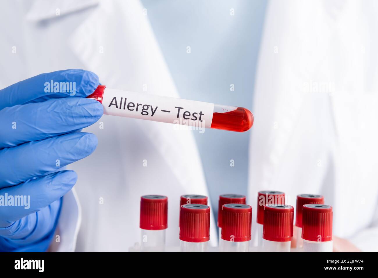 Cropped view of doctor holding tube with allergy test lettering Stock ...