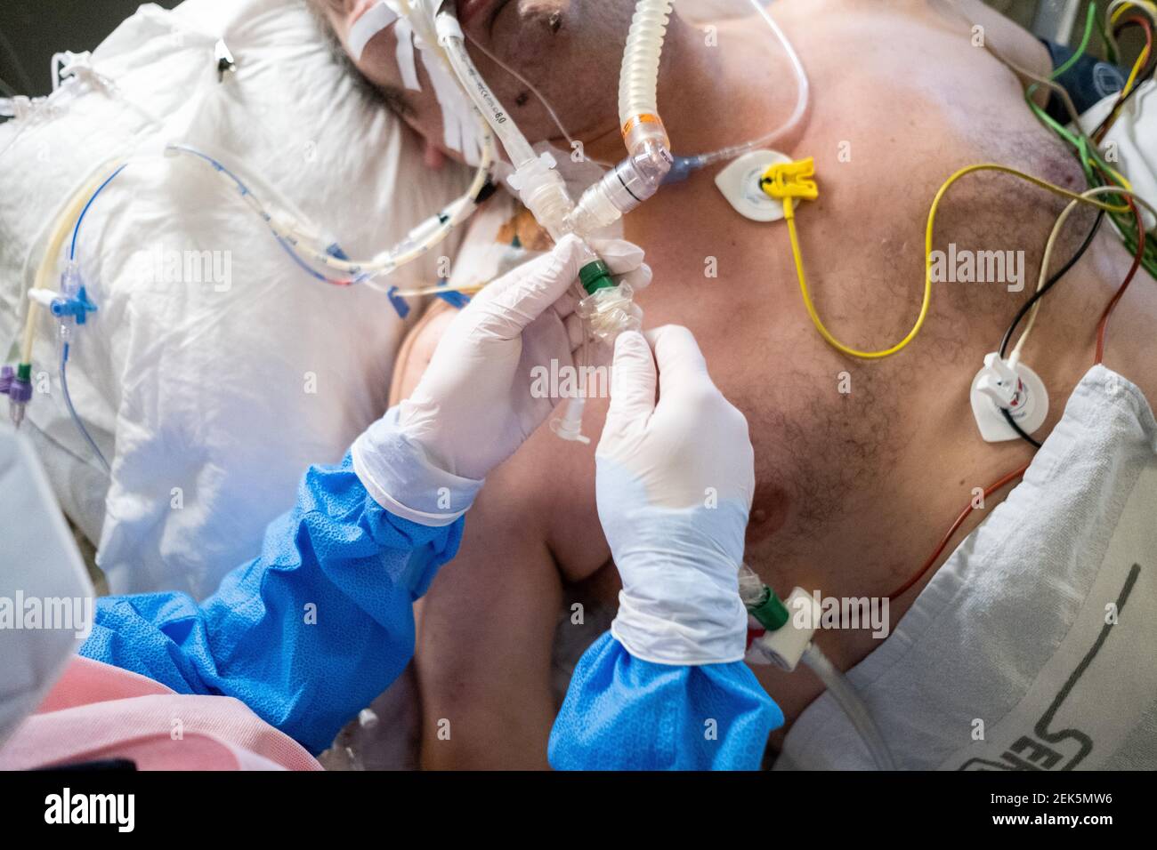 Report at the intensive care unit of the Liege hospital with patients ...