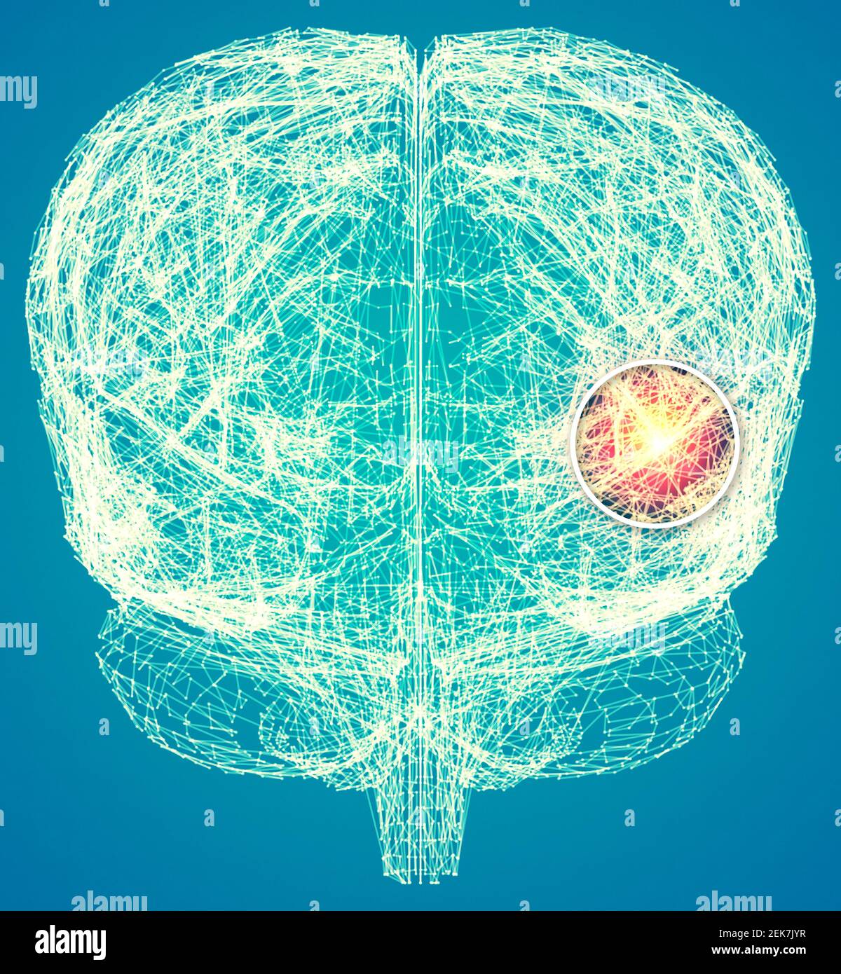 Trauma brain hi-res stock photography and images - Alamy