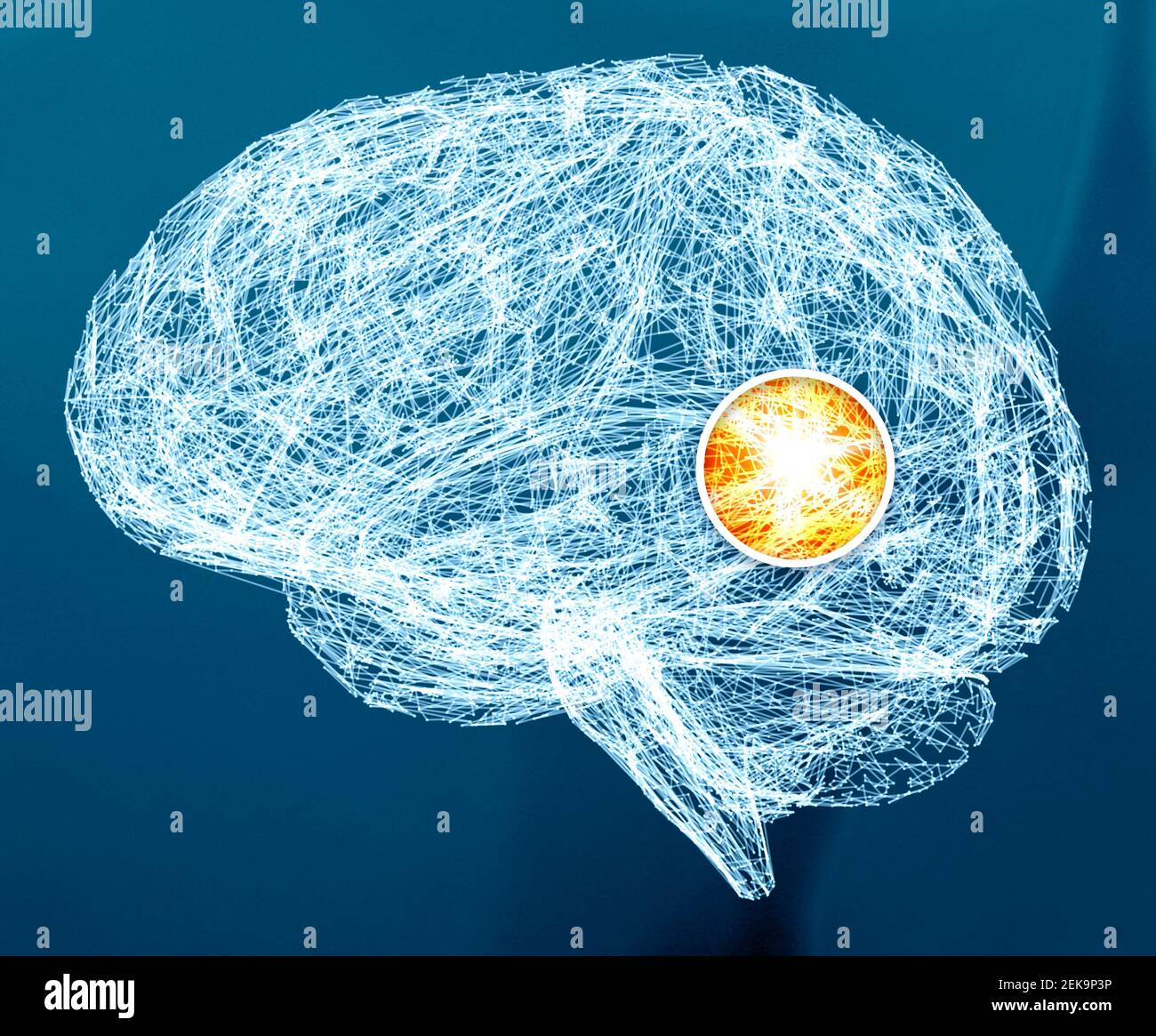 Memory lapses, forgetting things, degenerative disease. Brain problems ...