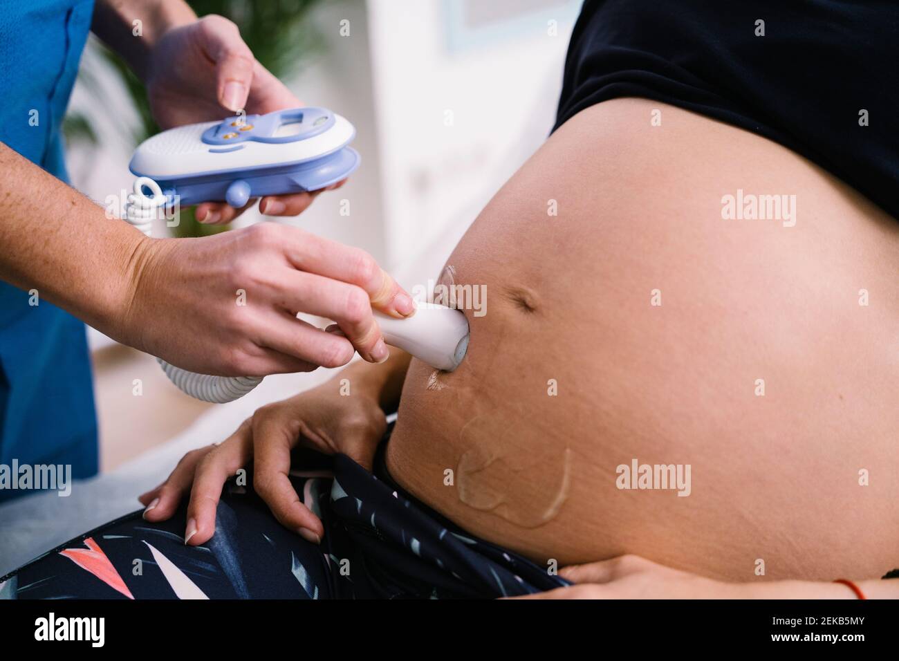 Baby ultrasound heartbeat hi-res stock photography and images - Alamy