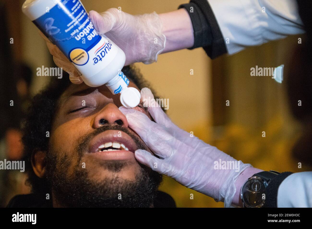 A counterprotestor gets his eyes rinsed out after being sprayed by ...