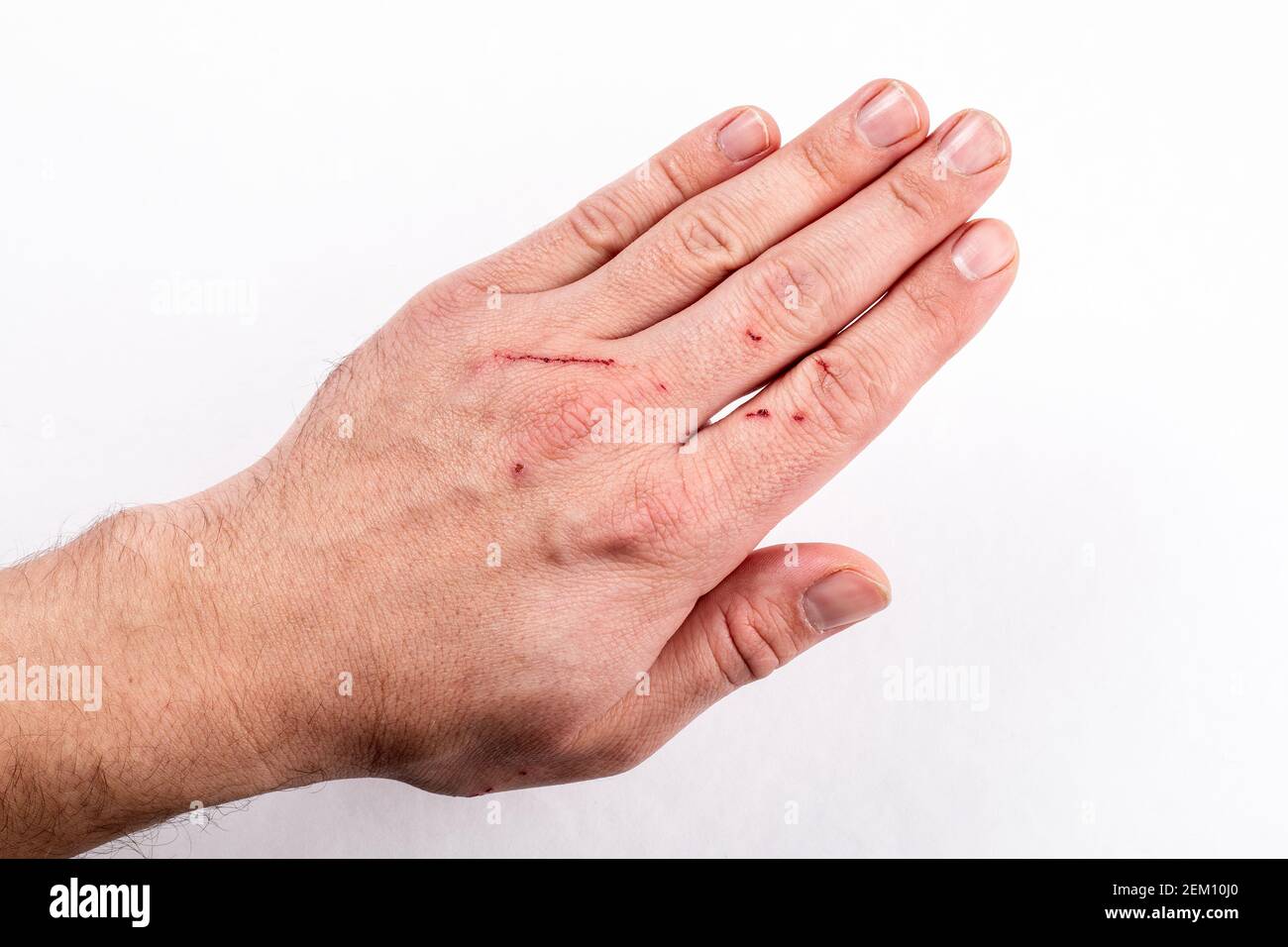 Jesus Christ Hands Scar Red