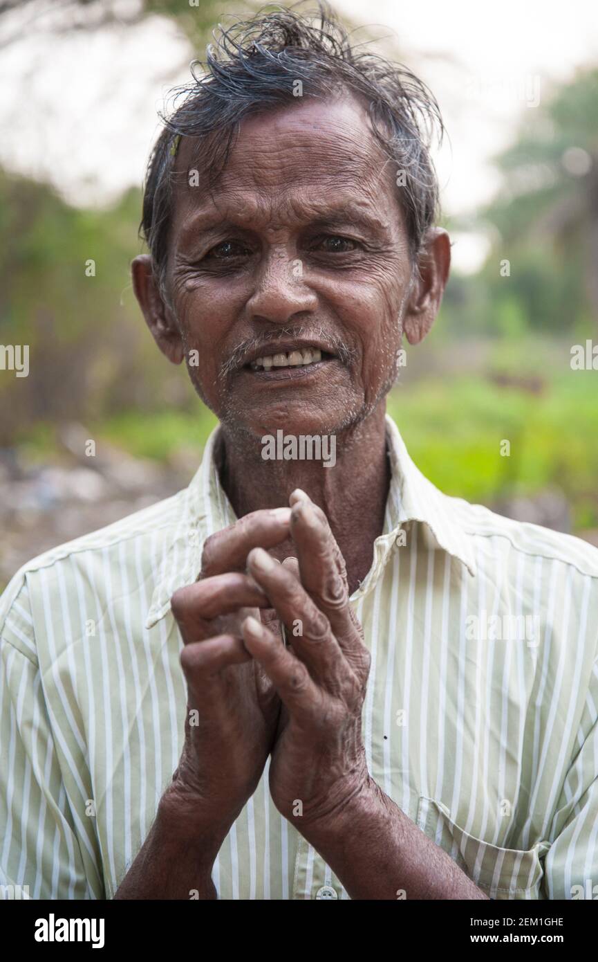 Nellore, Andhra Pradesh, India: Man with leprosy residing in a ...
