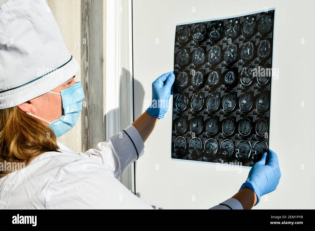 Doctor in protecting gloves holding brain MRI in medical office. MRI ...