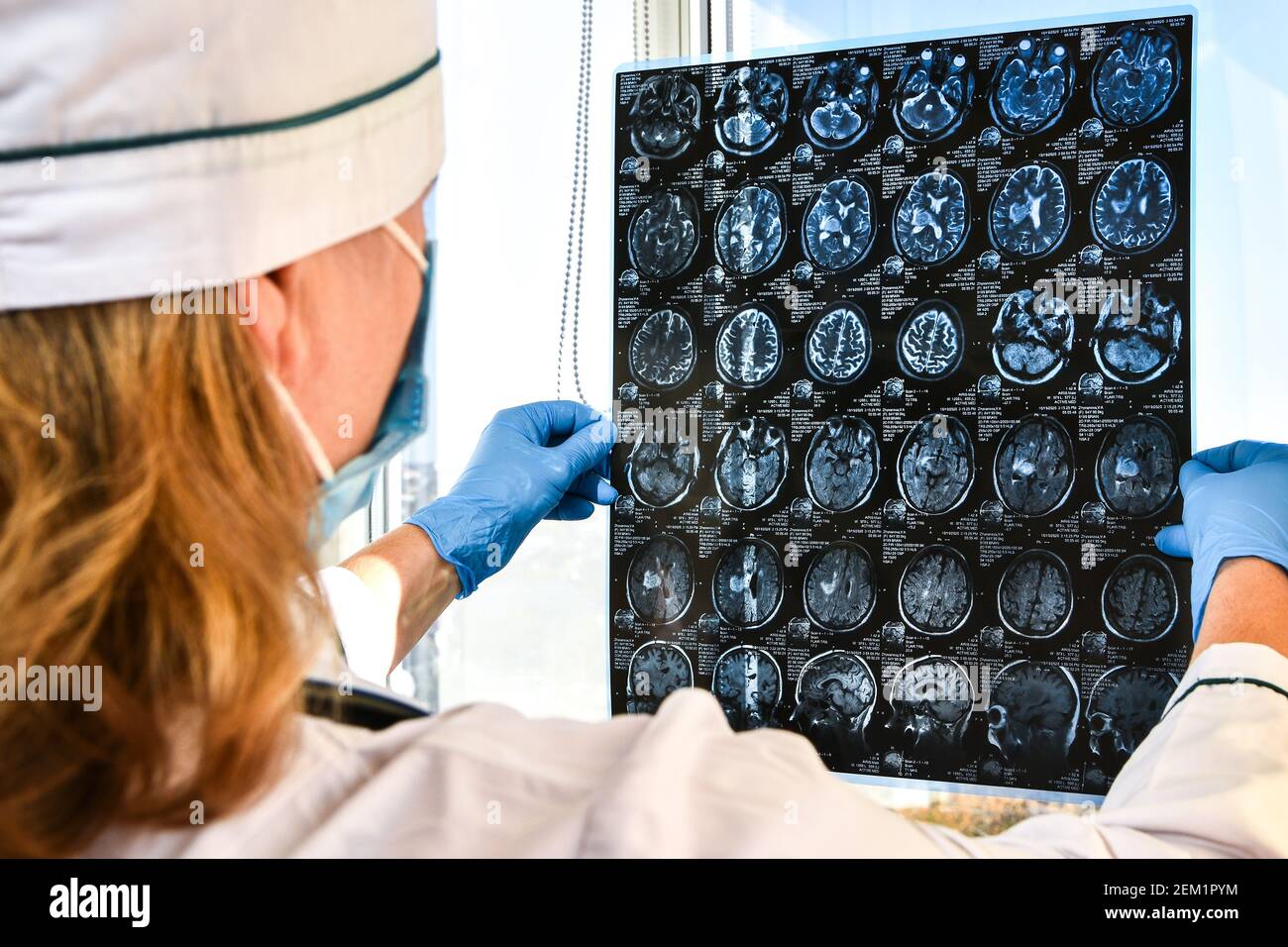 Doctor in protecting gloves holding brain MRI in medical office. MRI ...