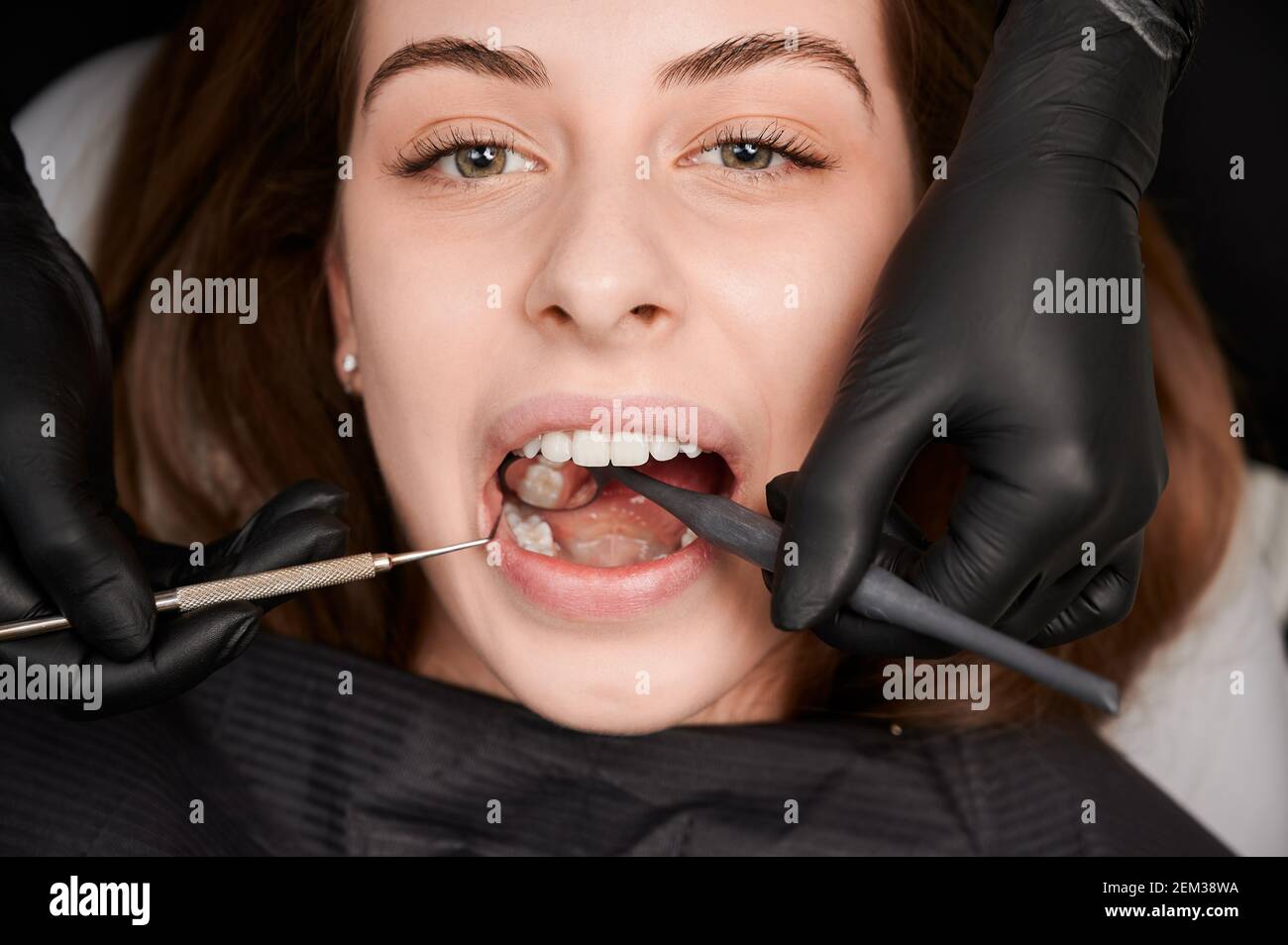 Close up woman mouth open teeth hi-res stock photography and images - Alamy