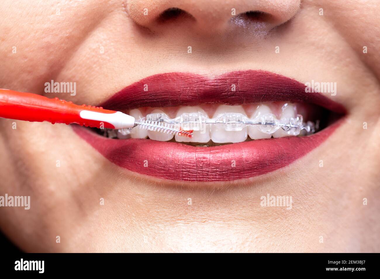 Proxabrush for in between teeth area hygiene, braces concept Stock ...