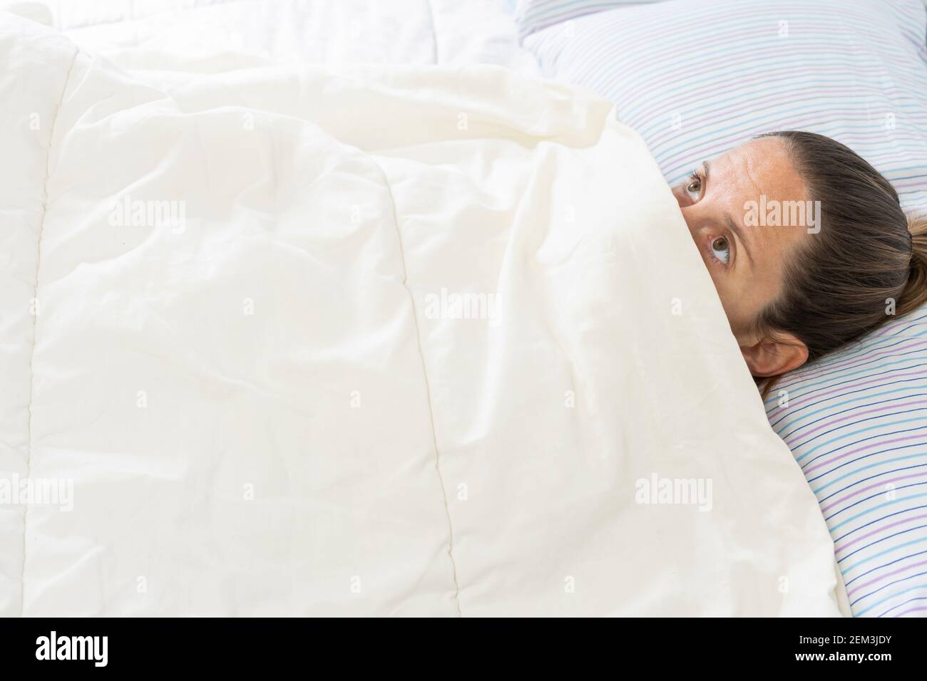 People Sleeping With Their Eyes Open