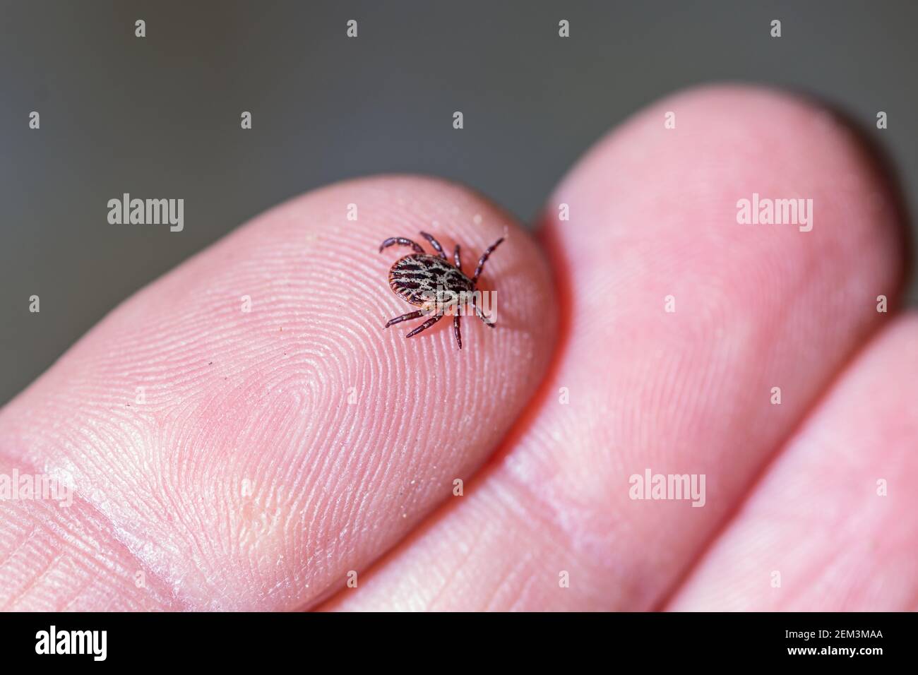 Closeup of a tick on a finger Stock Photo - Alamy
