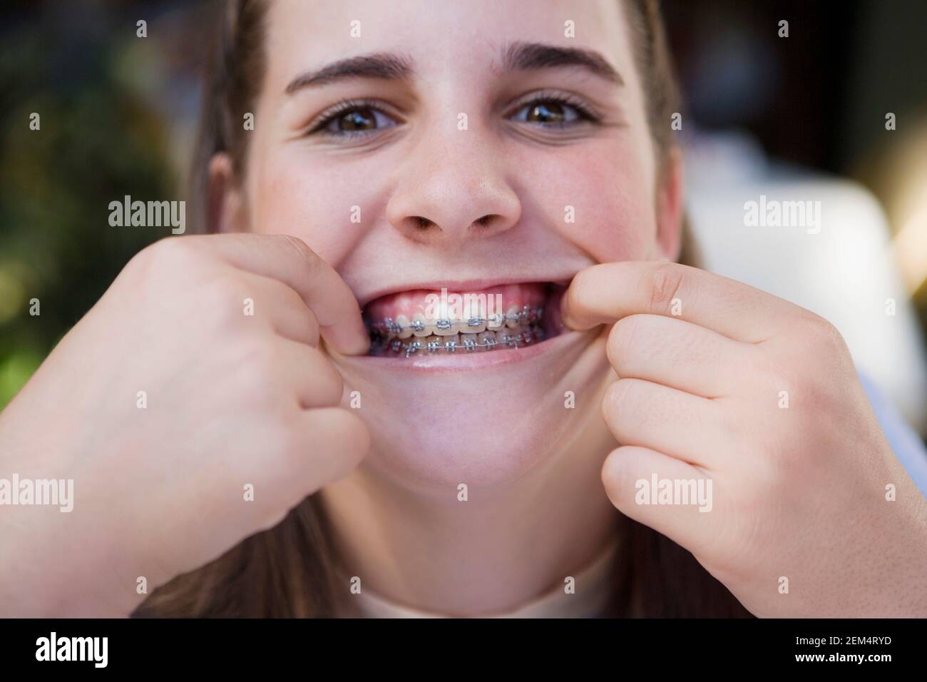 Portrait of a teenage girl stretching her lips Stock Photo - Alamy