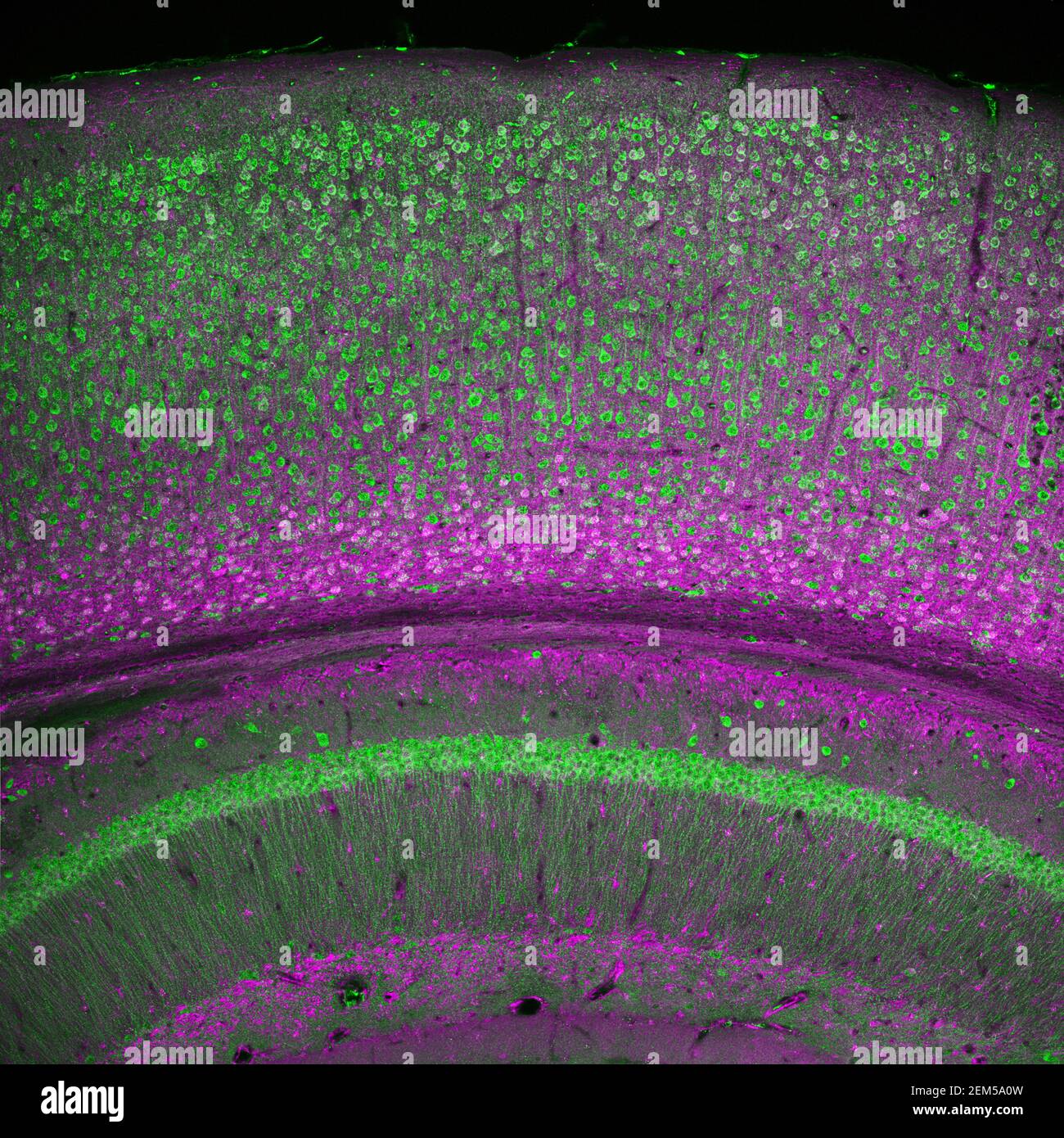 Cerebral cortex and part of the hippocampus in a section of a mouse ...