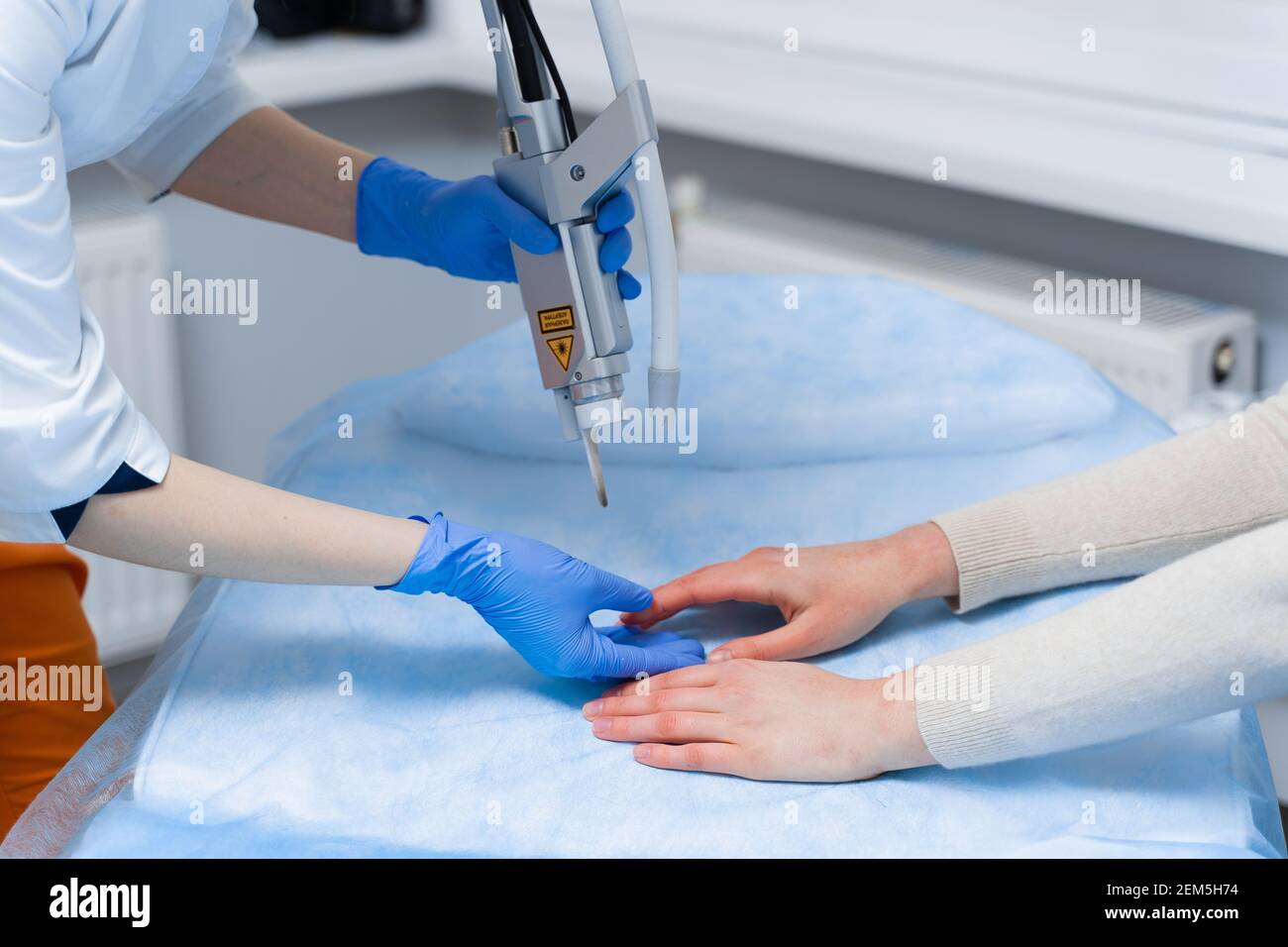 Laser treatment of onychomycosis. fungal infection on the hands of a ...